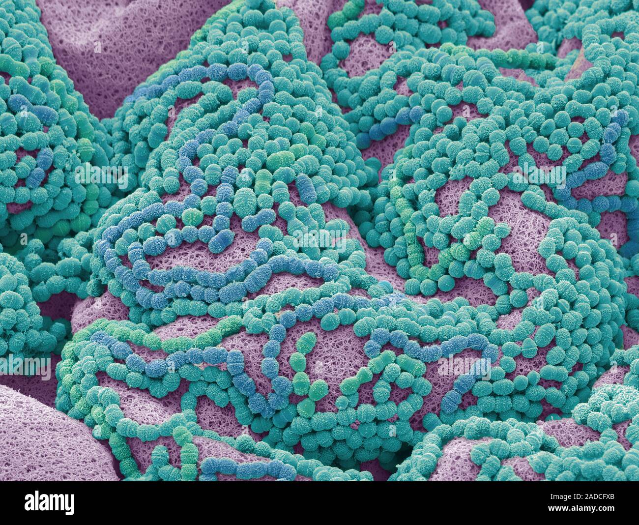 Tooth bacteria. Coloured scanning electron micrograph (SEM) of bacteria ...