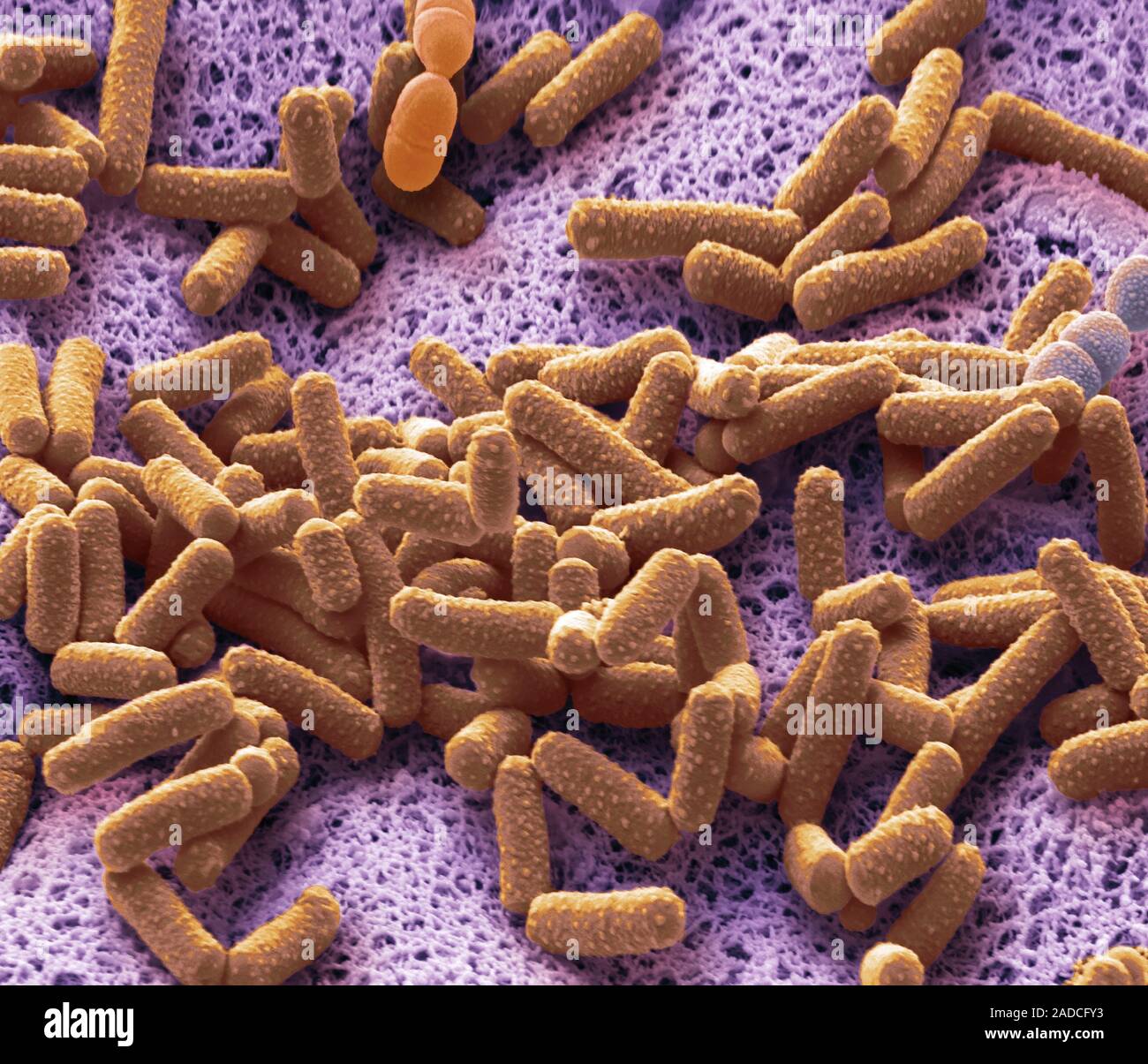 Pasteurella multocida. Coloured scanning electron micrograph (SEM) of Pasteurella multocida ...