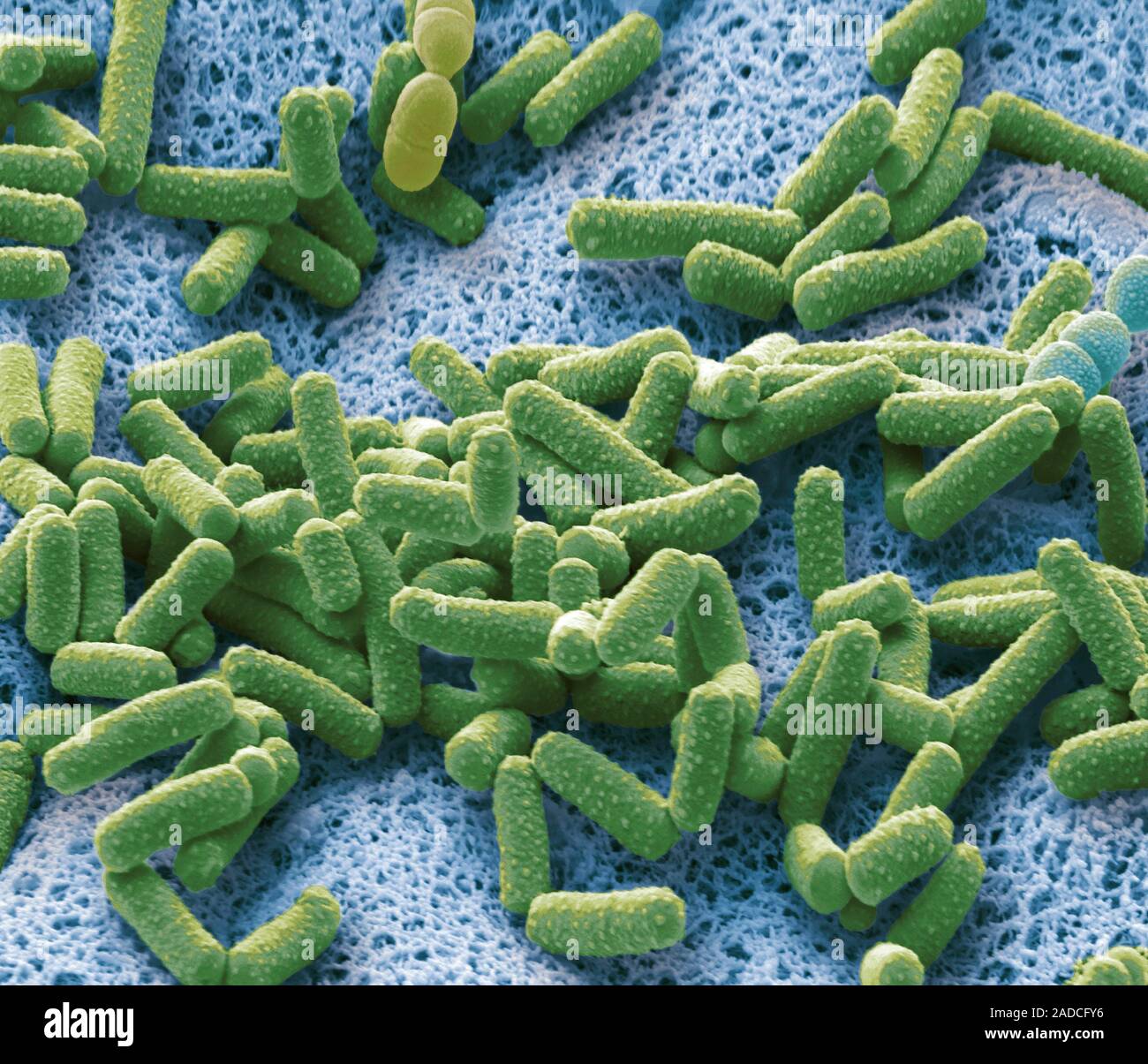 Pasteurella multocida. Coloured scanning electron micrograph (SEM) of Pasteurella multocida ...