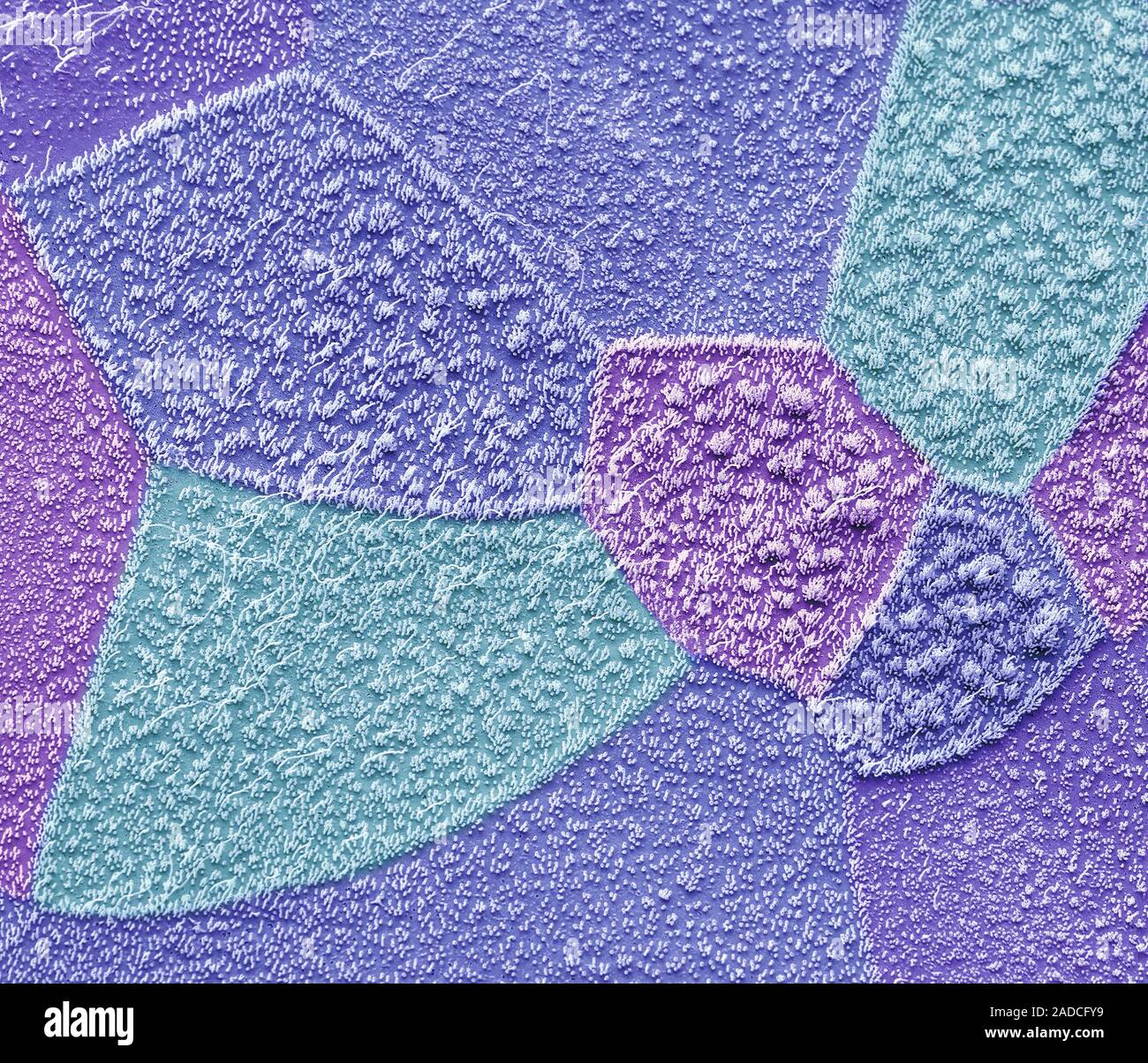 Bronchial epithelium. Coloured scanning electron micrograph (SEM) of ...