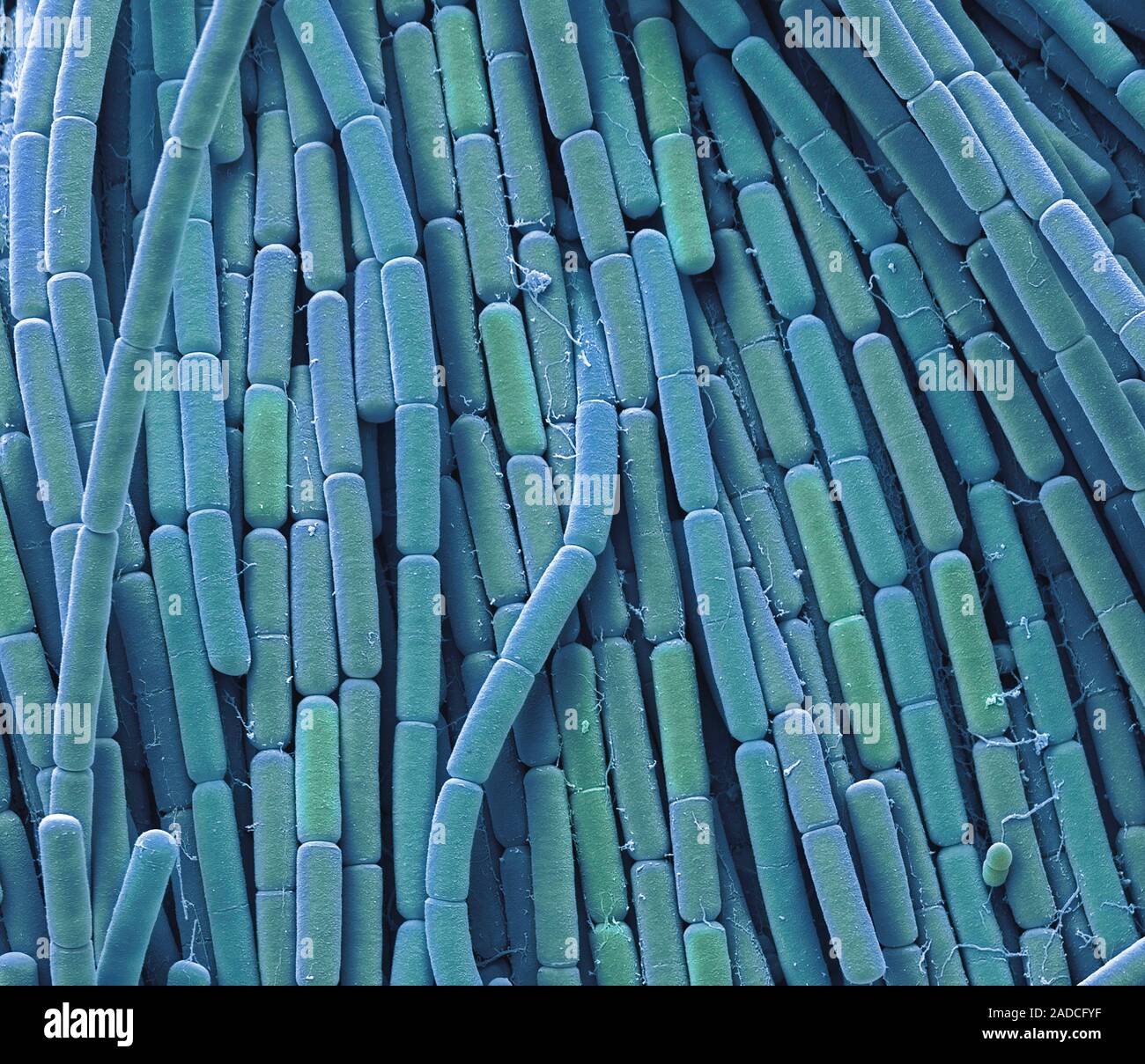 Clostridium villosum. Coloured scanning electron micrograph (SEM) of ...