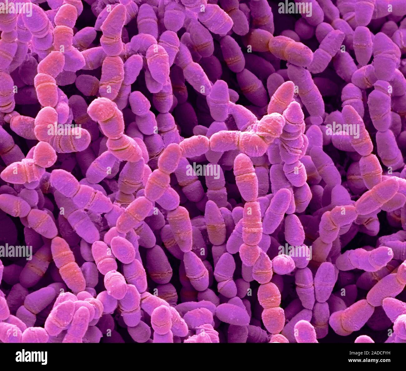 Staphylococcus epidermidis. Coloured scanning electron micrograph (SEM ...