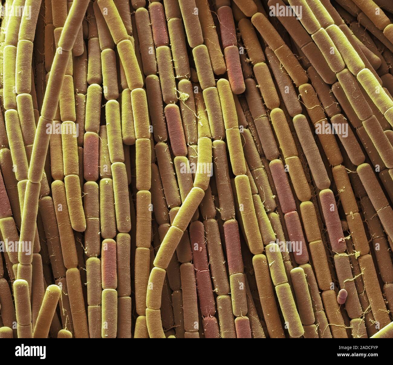 Clostridium villosum. Coloured scanning electron micrograph (SEM) of ...