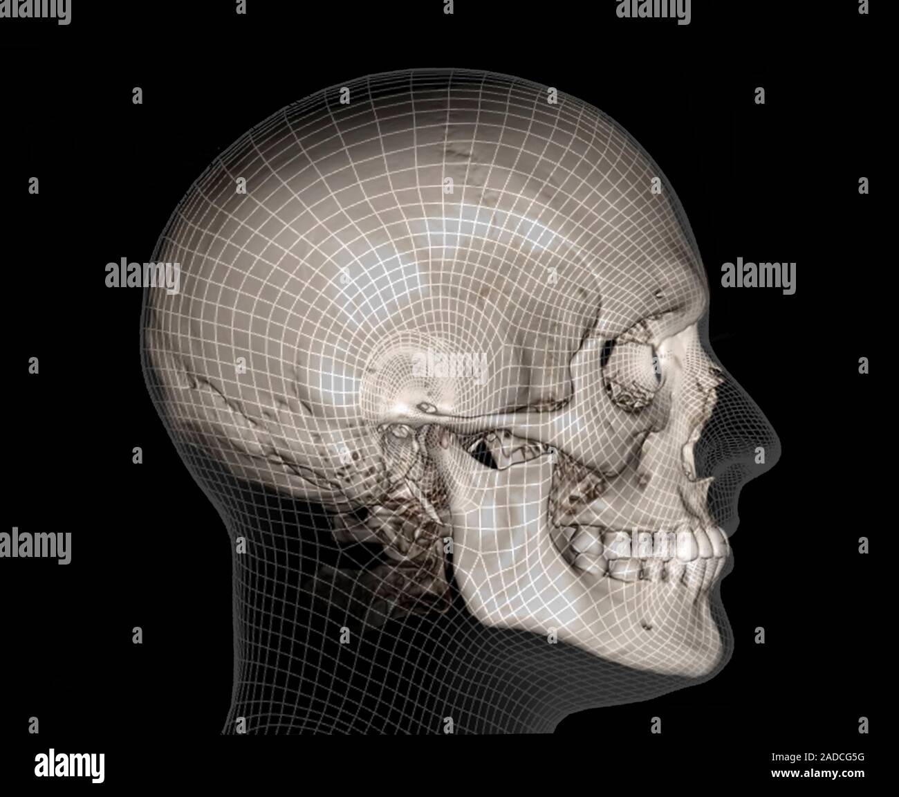 Human skull. 3D computed tomography (CT) scan of a side view of the ...