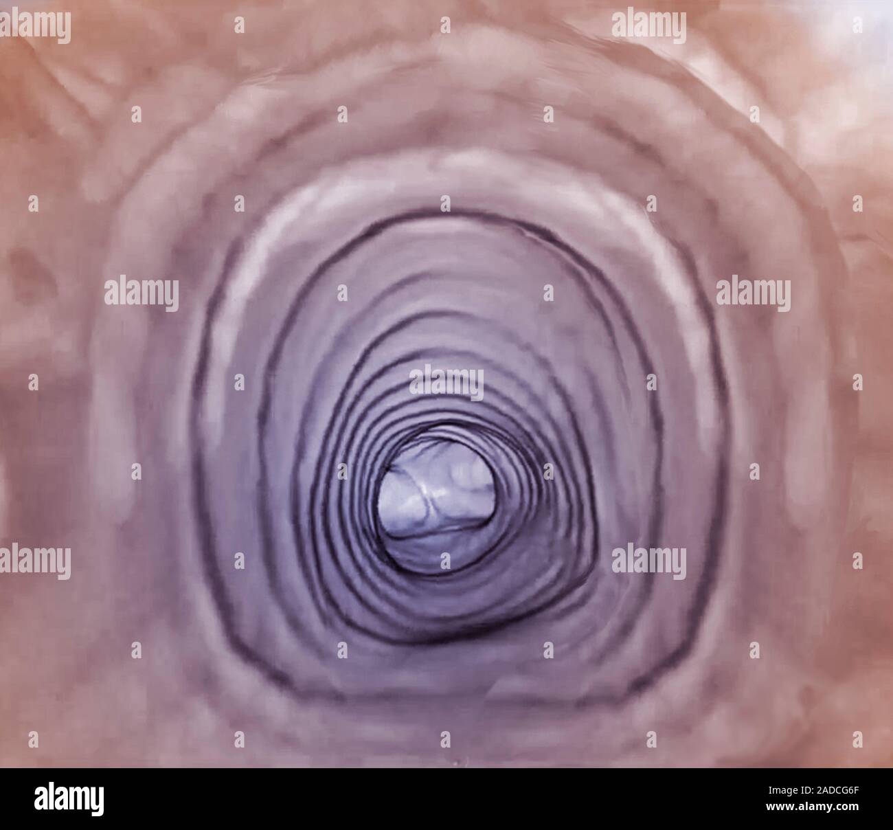 Trachea. Coloured 3D computed tomography (CT) scan of the inside of the ...