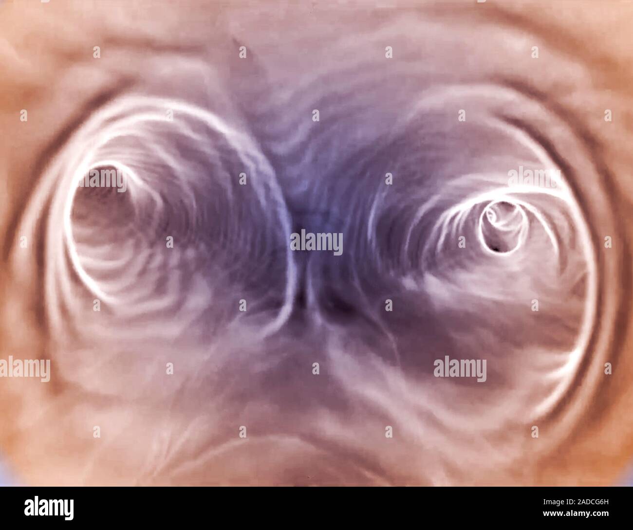 Trachea-bronchi division. Coloured 3D computed tomography (CT) scan of ...