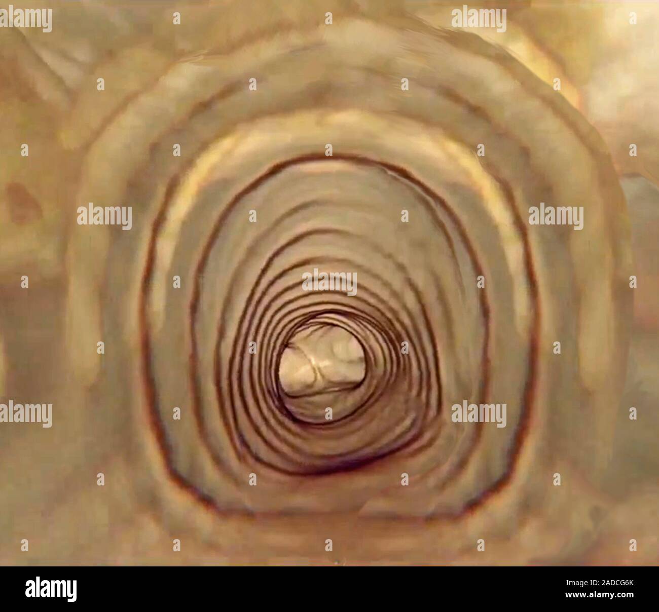 Trachea. Coloured 3D computed tomography (CT) scan of the inside of the ...