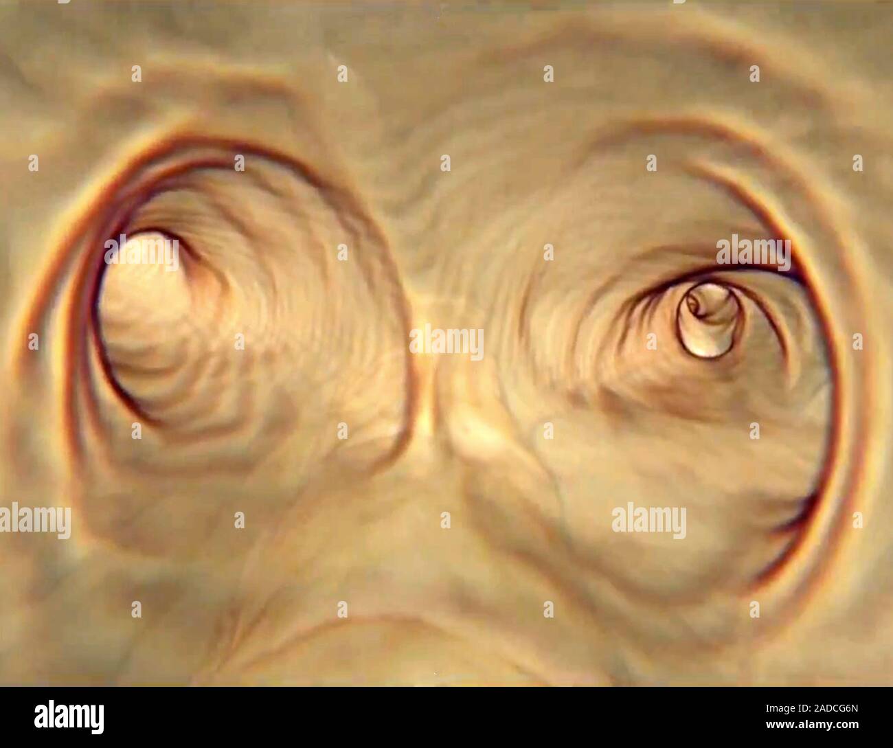 Trachea-bronchi division. Coloured 3D computed tomography (CT) scan of ...