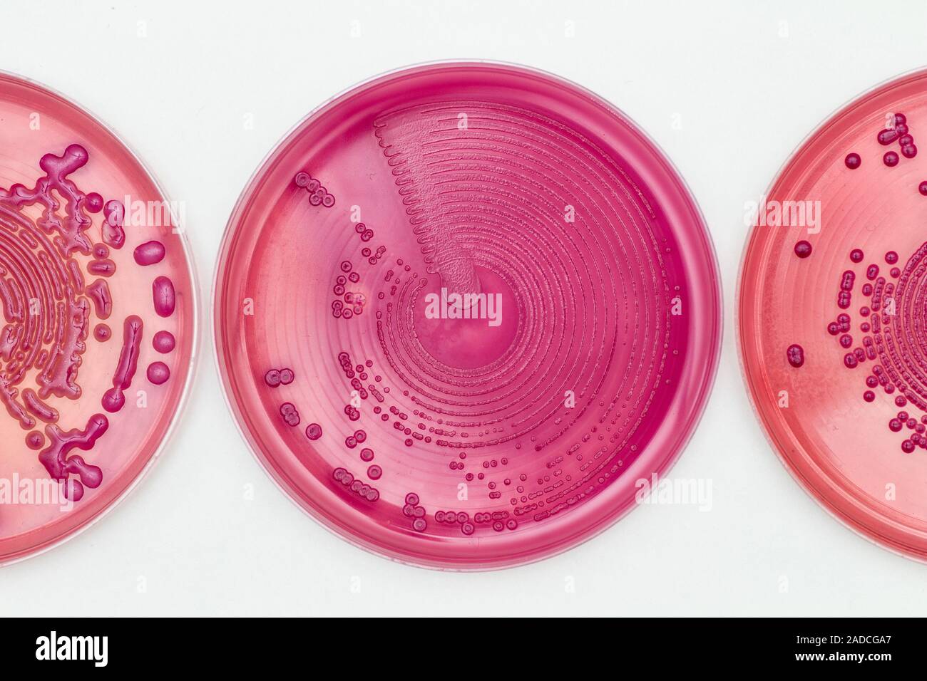 Bacteria cultures in MacConkey agar. Selection of Petri dishes with ...