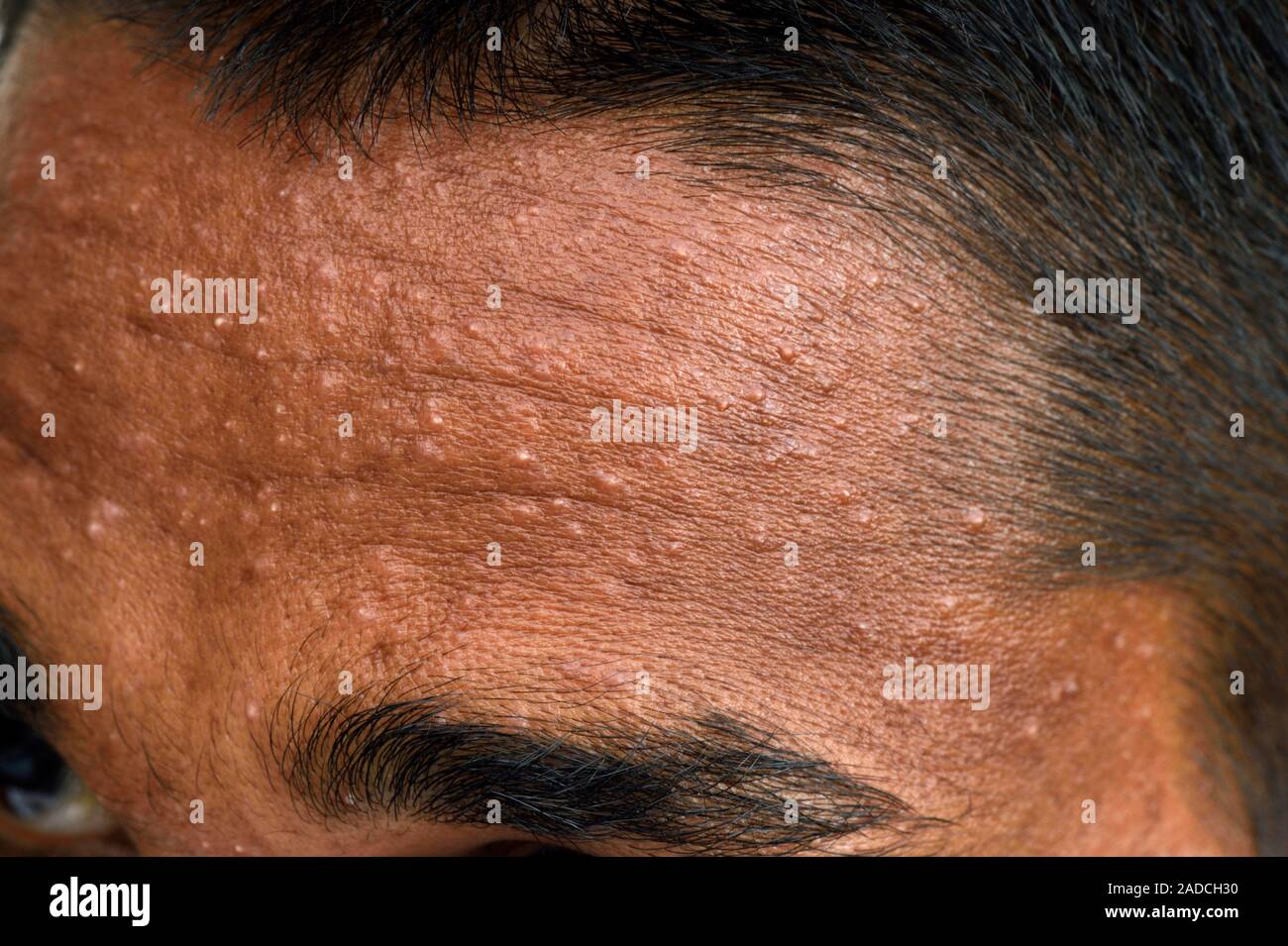 Not for use in Television Not for use in Television Milia on the ...