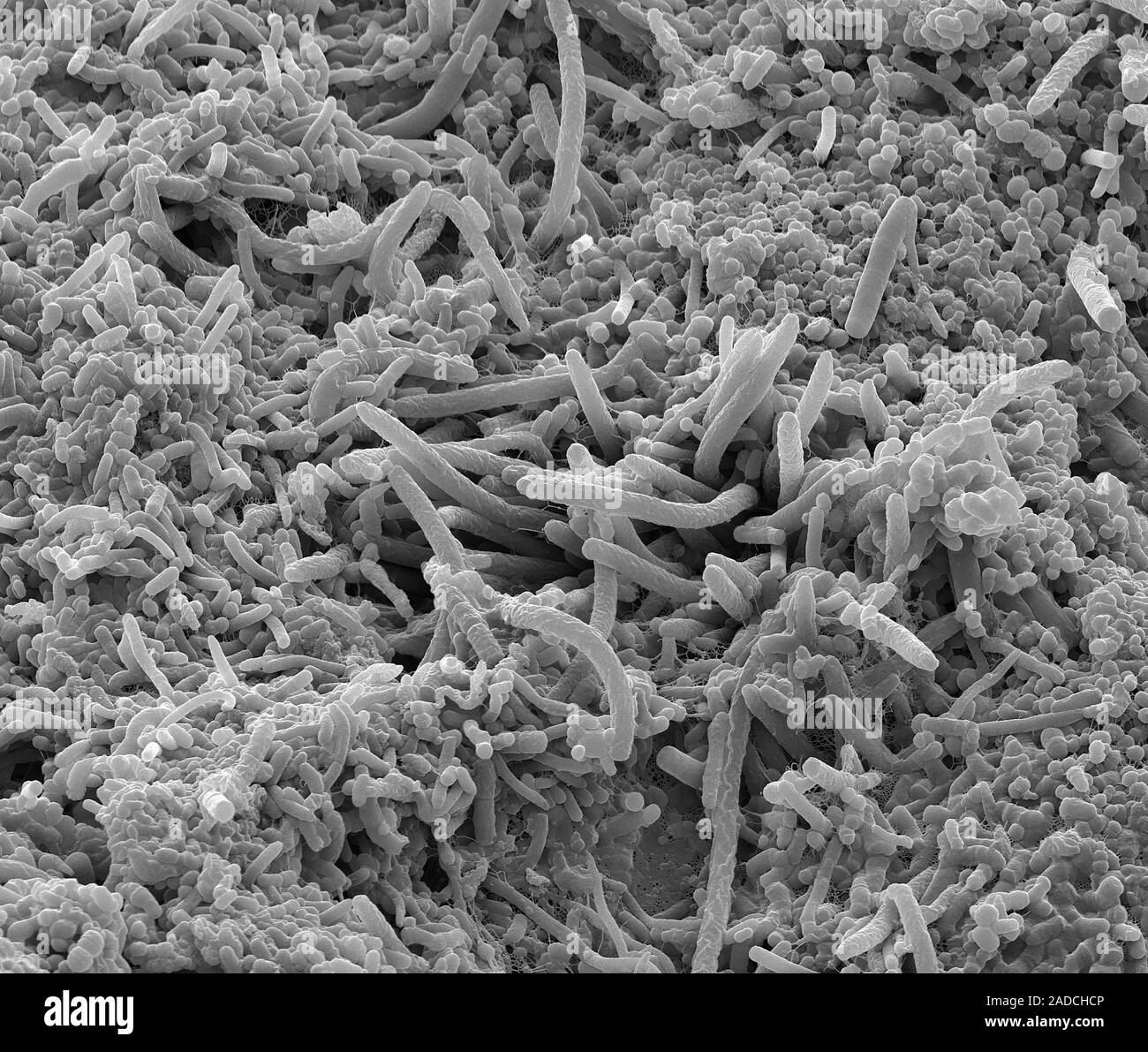 Oral bacteria. Scanning electron micrograph (SEM) of mixed oral ...