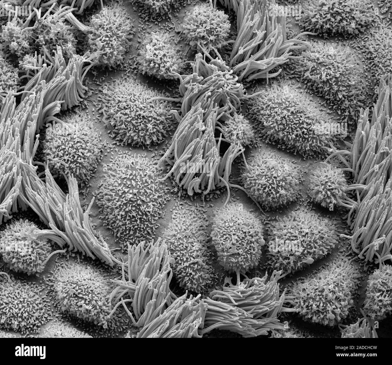 Fallopian tube. Scanning electron micrograph (SEM) of the surface of a ...