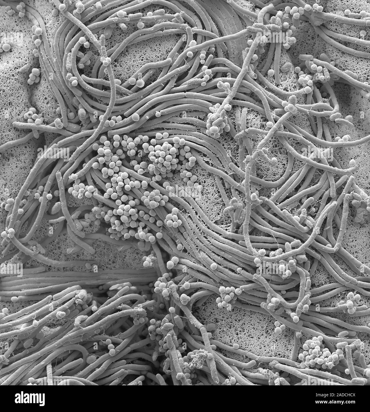 Scanning electron micrograph (SEM) of bacteria cultured from a mobile ...