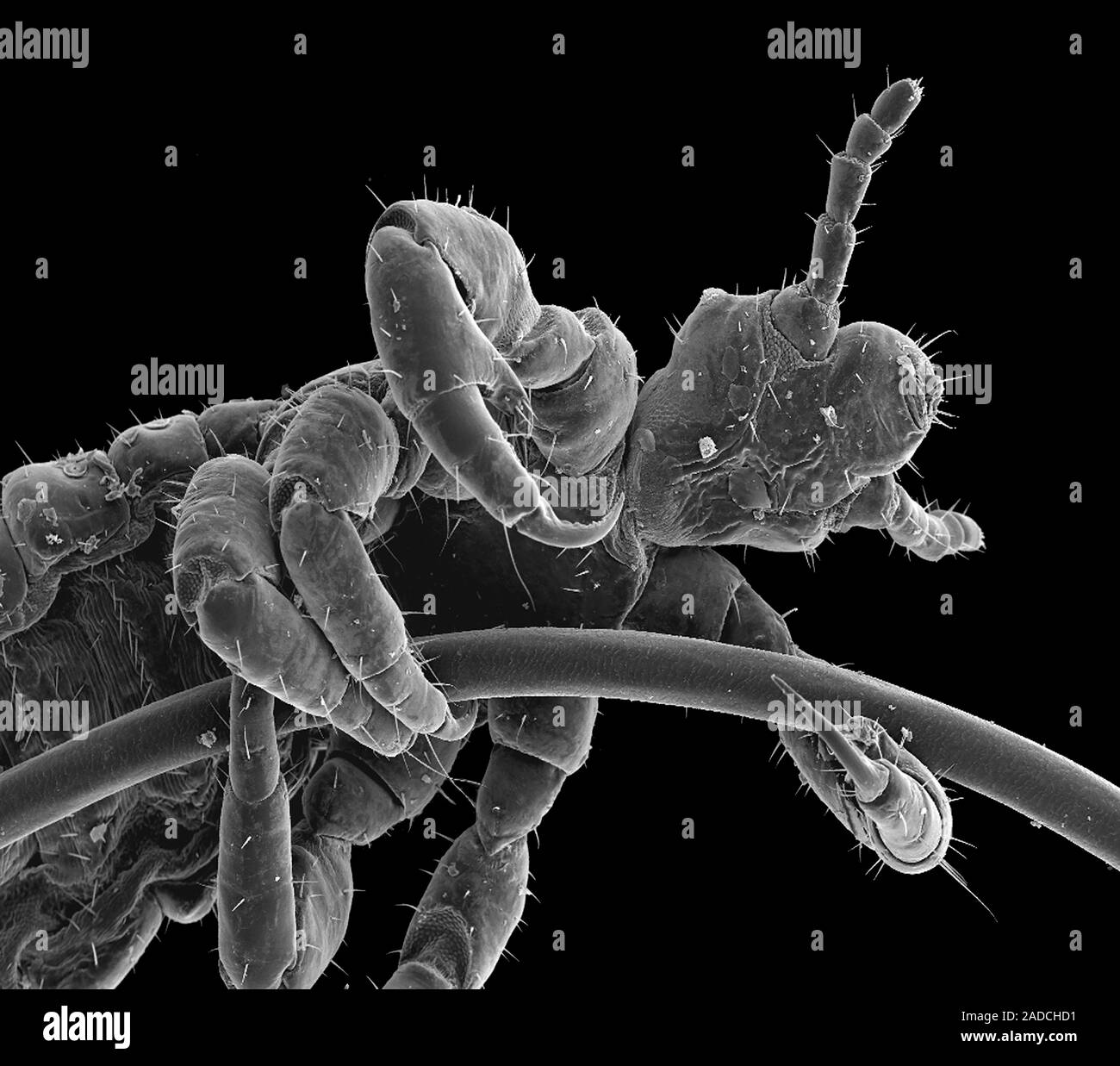 Head louse. Scanning electron micrograph (SEM) of the head and thorax ...