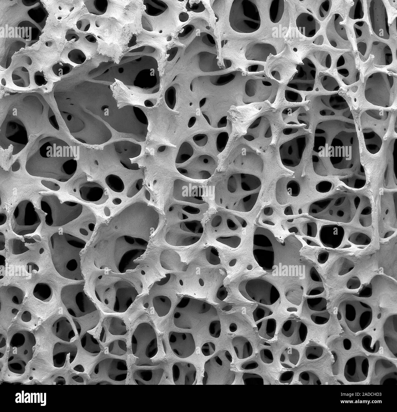 Bone tissue. Scanning electron micrograph (SEM) of cancellous (spongy ...