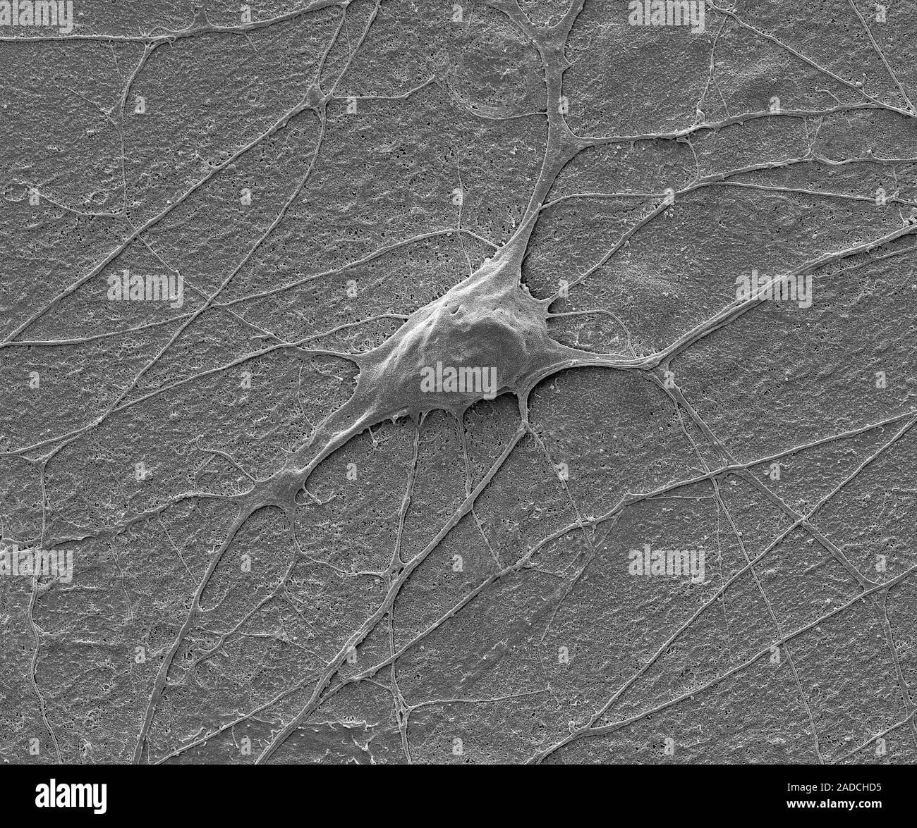 Stem cell-derived motor neuron.Scanning electron micrograph (SEM) of a ...