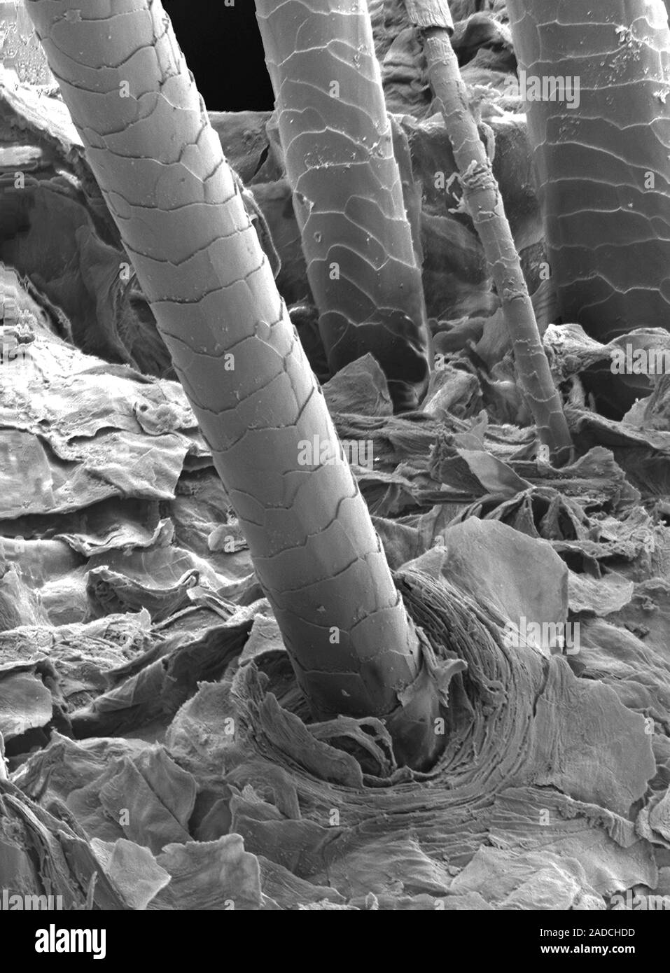 Human hair. Scanning electron micrograph (SEM) of human hairs emerging ...
