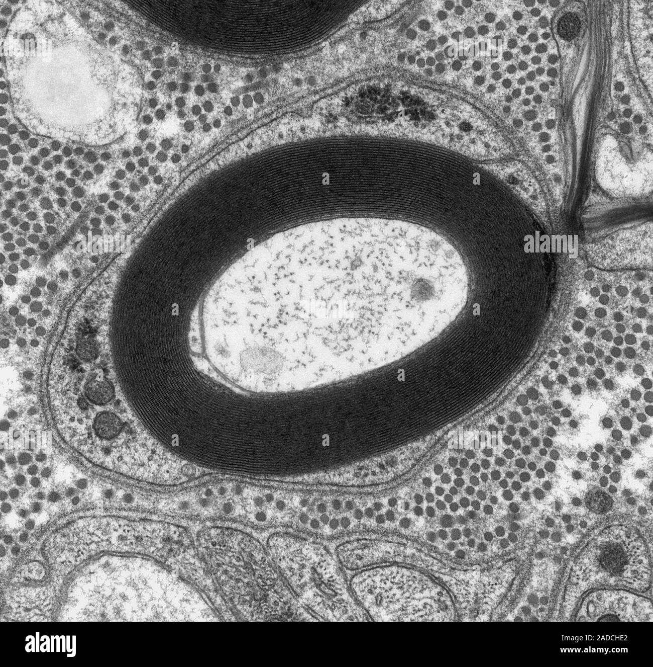 Myelinated nerve. Transmission electron micrograph (TEM) of myelinated ...