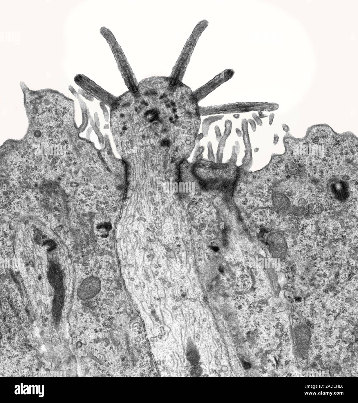 Smell receptor. Transmission electron micrograph (TEM) of a section ...