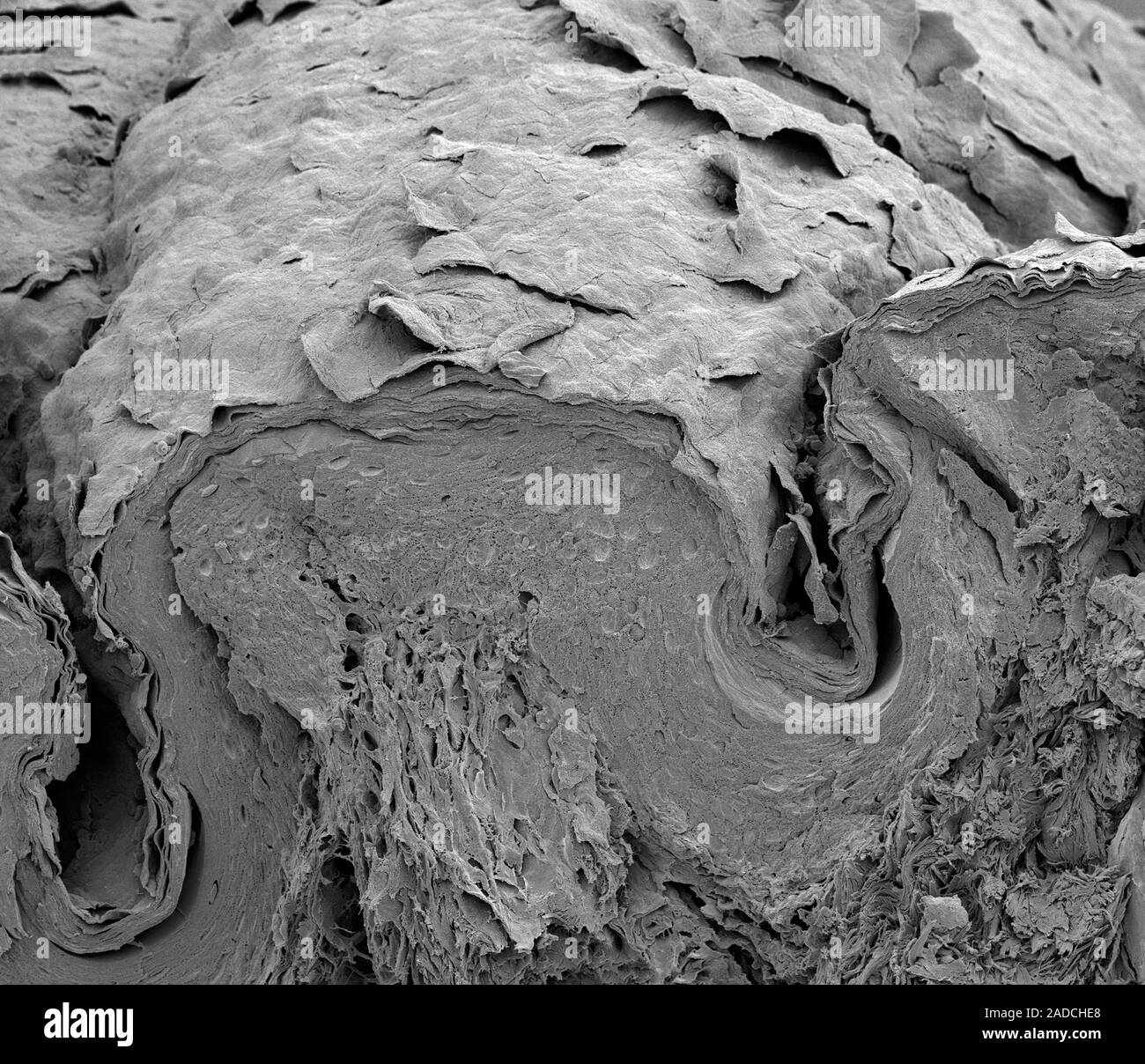 Skin tissue. Scanning electron micrograph (SEM) of a freeze-fracture ...