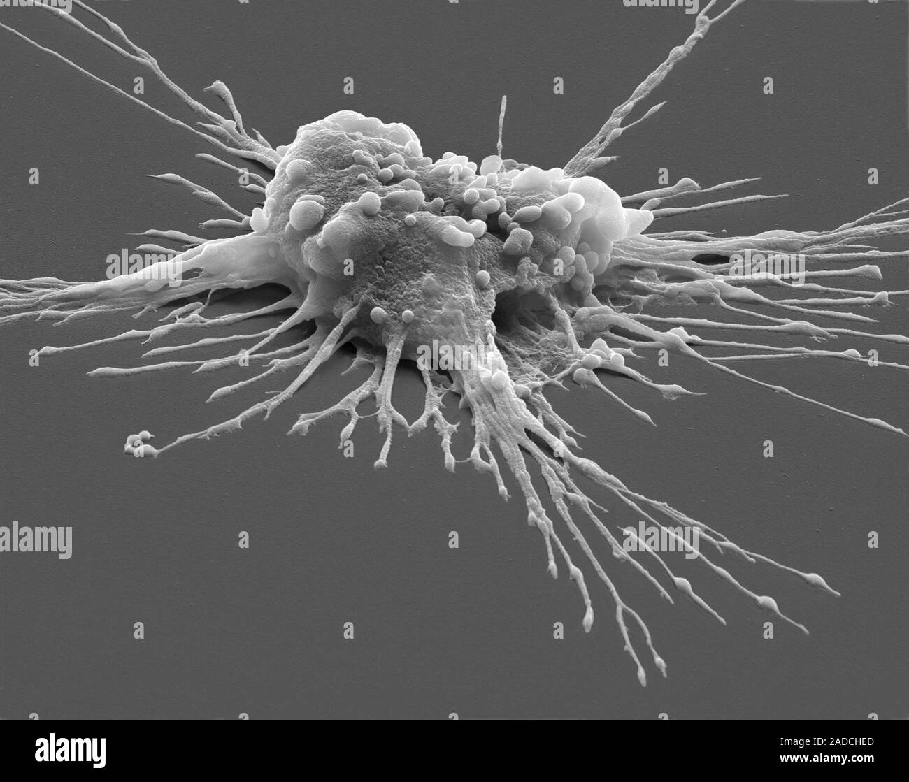 Pluripotent stem cell. Scanning electron micrograph (SEM) of a ...
