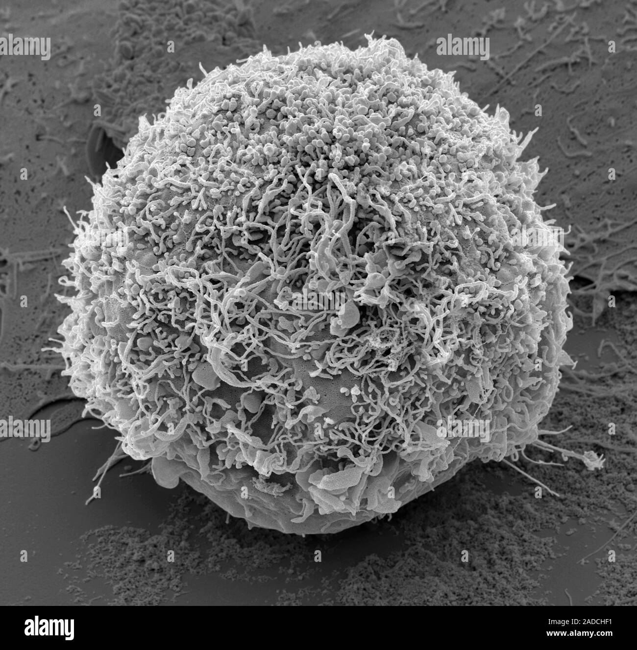 Mesenchymal Stem Cell Scanning Electron Micrograph Sem Of A Human Mesenchymal Stem Cell Msc