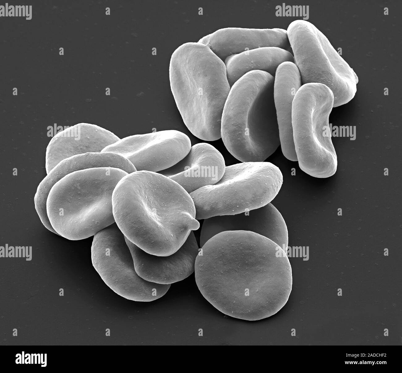 Red blood cells. Scanning electron micrograph (SEM) of red blood cells ...