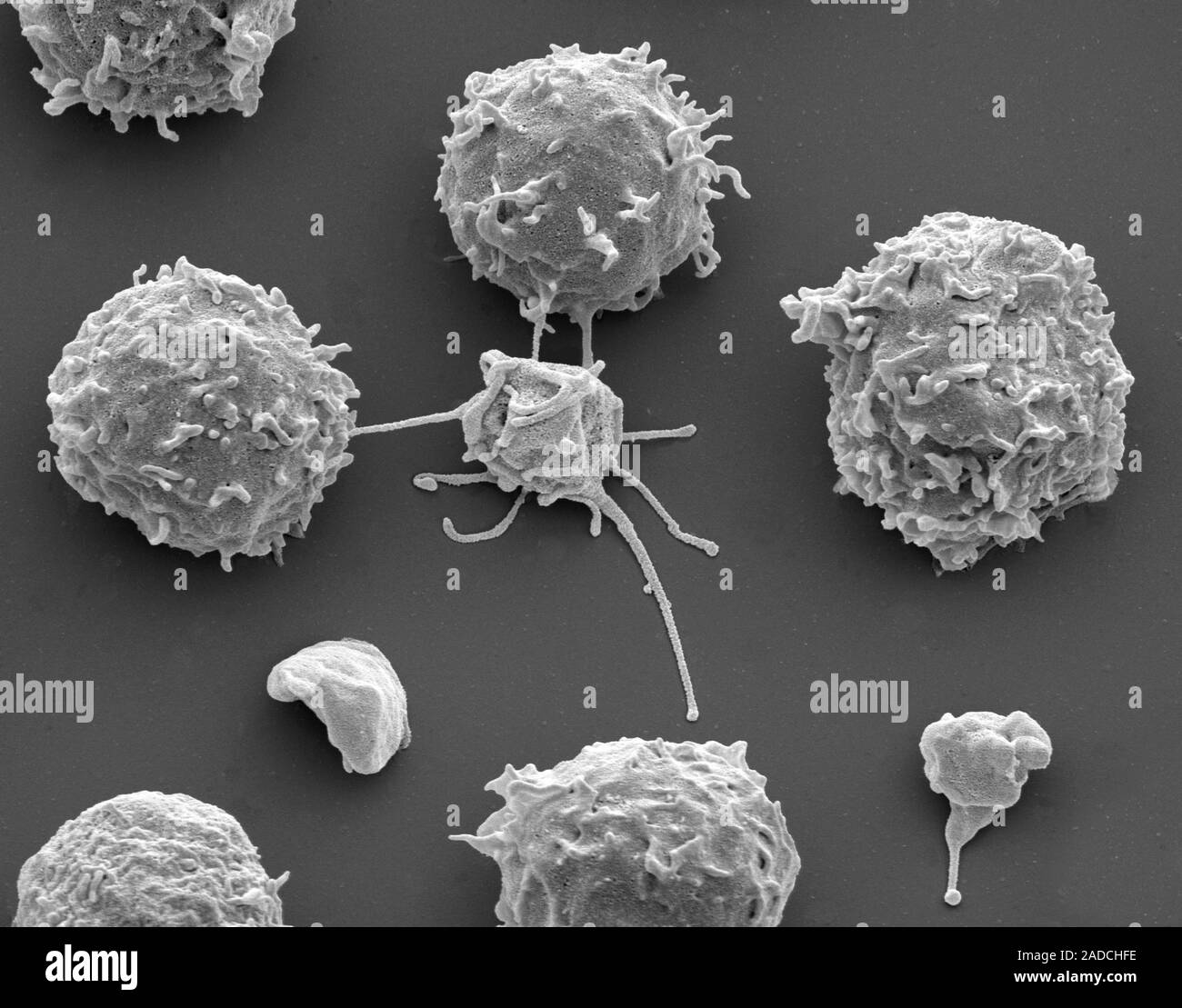White blood cells and platelets. Scanning electron micrograph (SEM) of ...