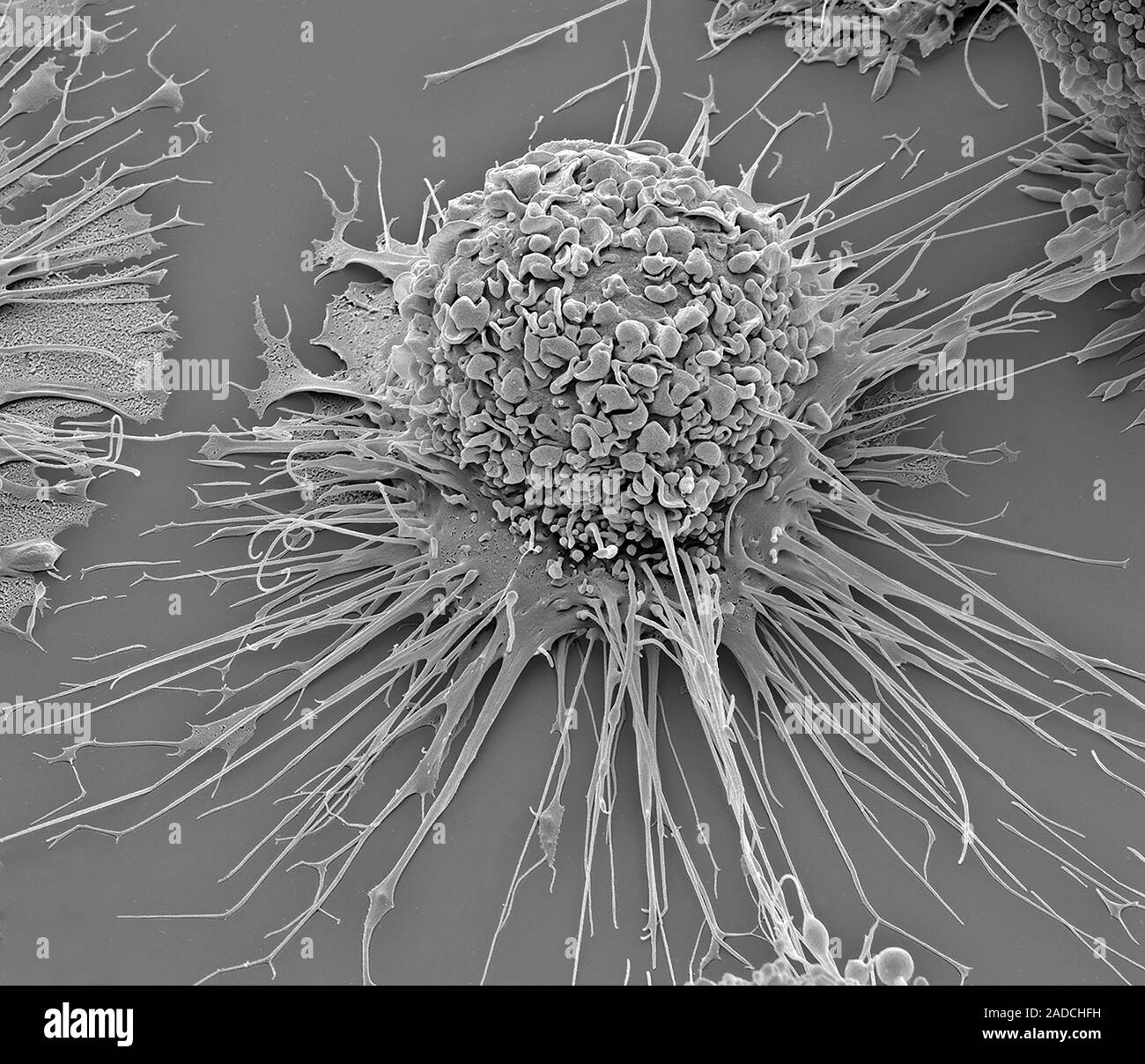 Activated macrophage. Scanning electron micrograph (SEM) of an active macrophage white blood ...