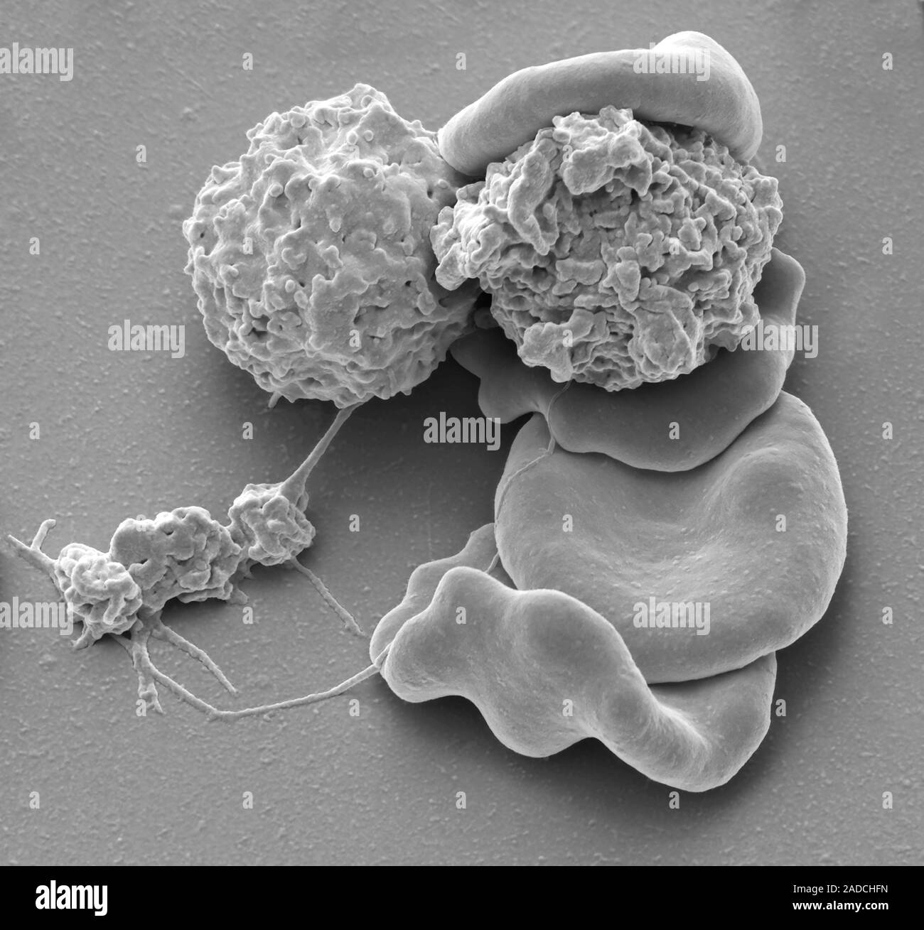 Human blood cells, Scanning electron micrograph (SEM) of a variety of ...