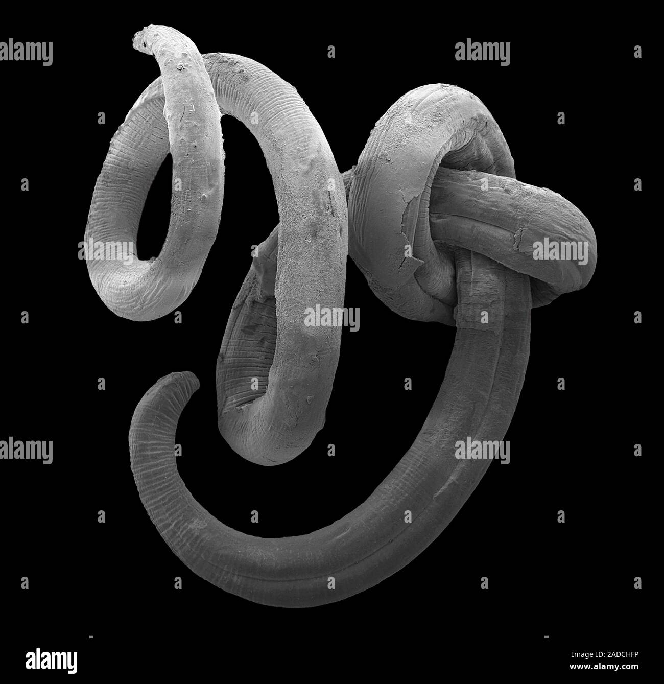 Threadworm, scanning electron micrograph (SEM). This is a nematode worm ...