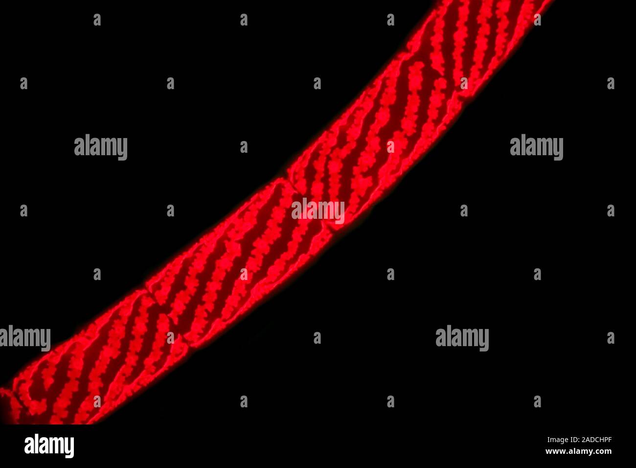 Light micrograph of Spirogyra sp., a freshwater filamentous green alga ...