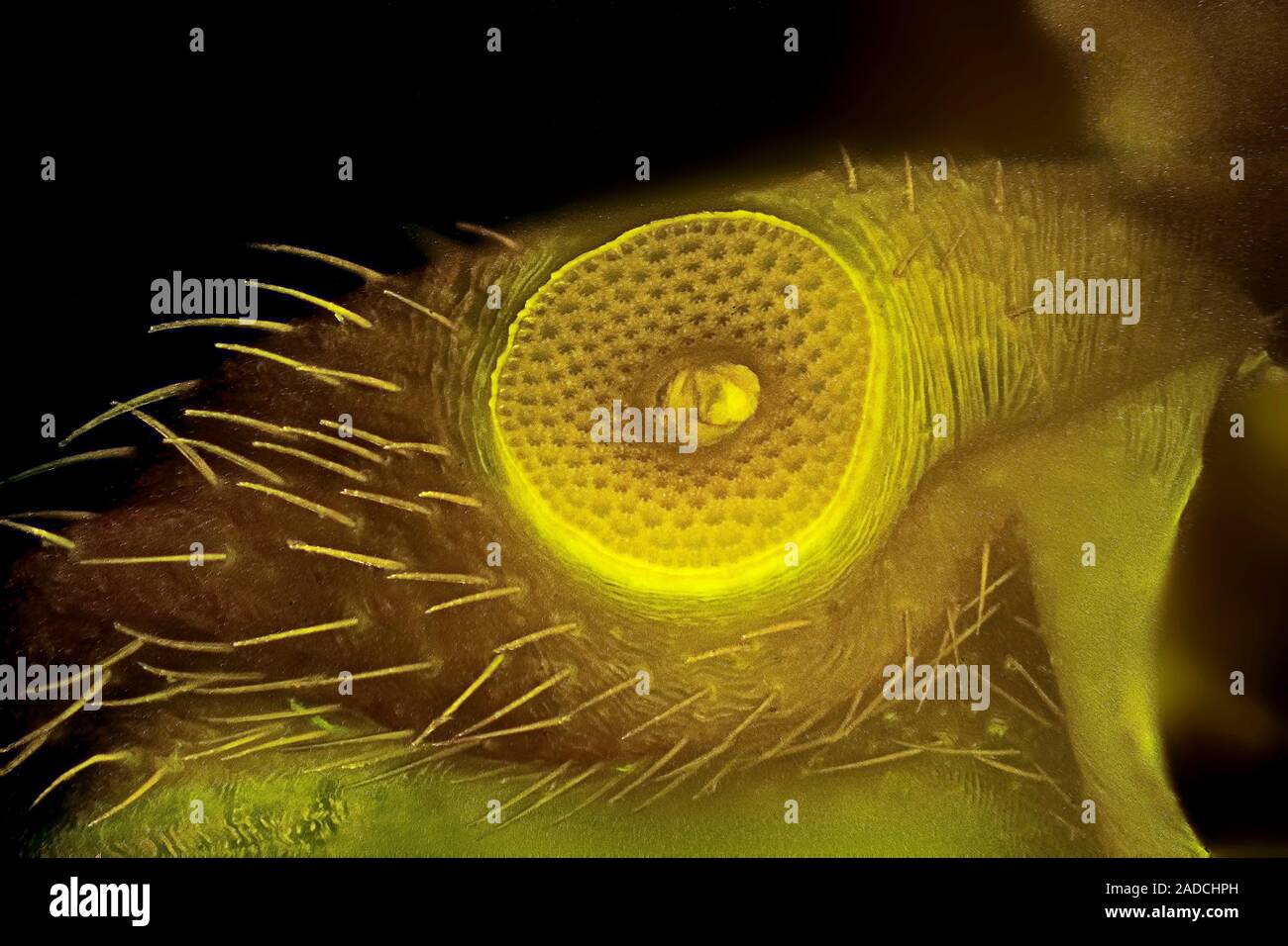 Light micrograph of a tick (family Ixodidae) spiracle. Microscopic ...