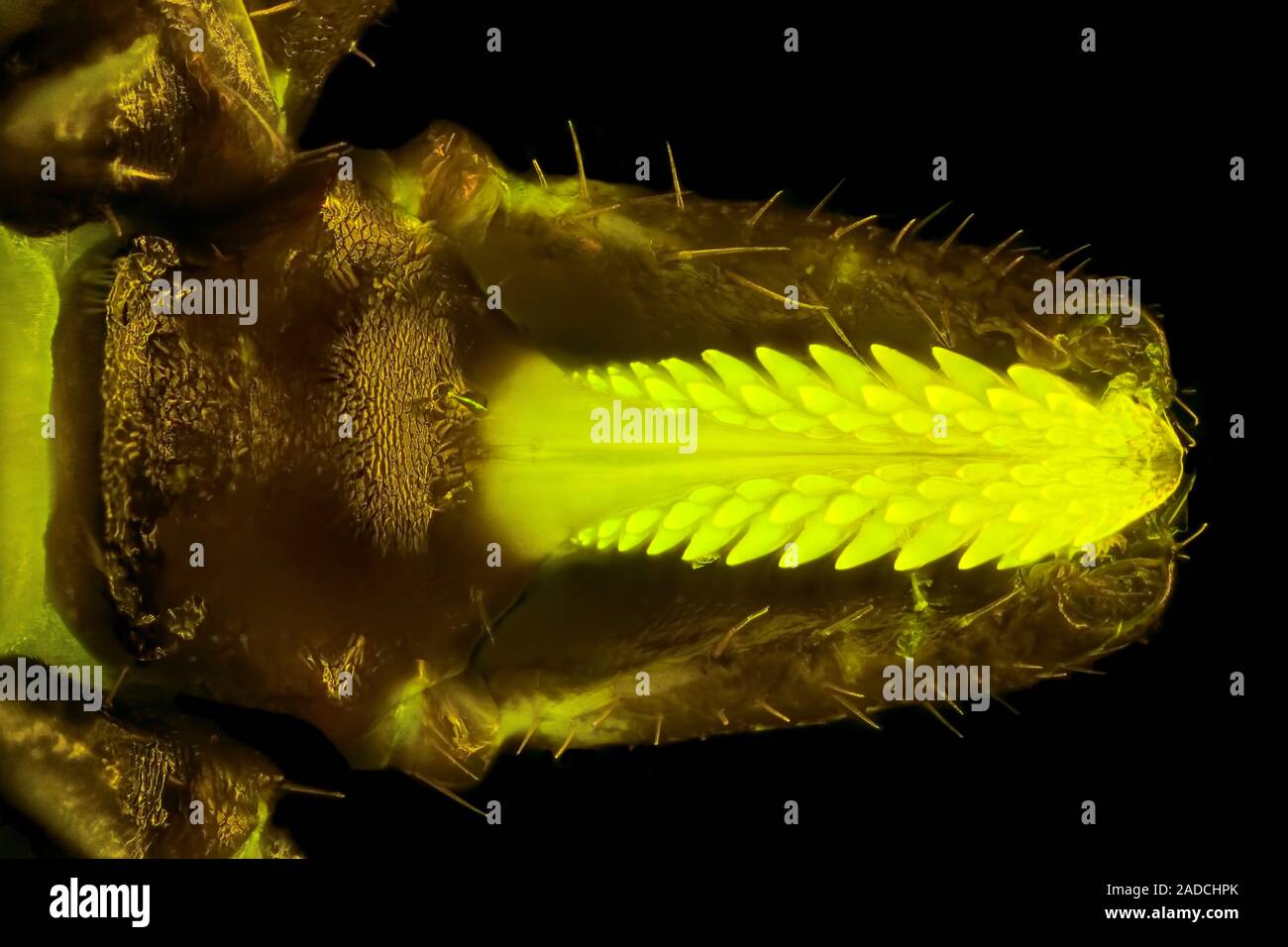 Tick (family Ixodidae) mouthparts, light micrograph. Microscopic ...