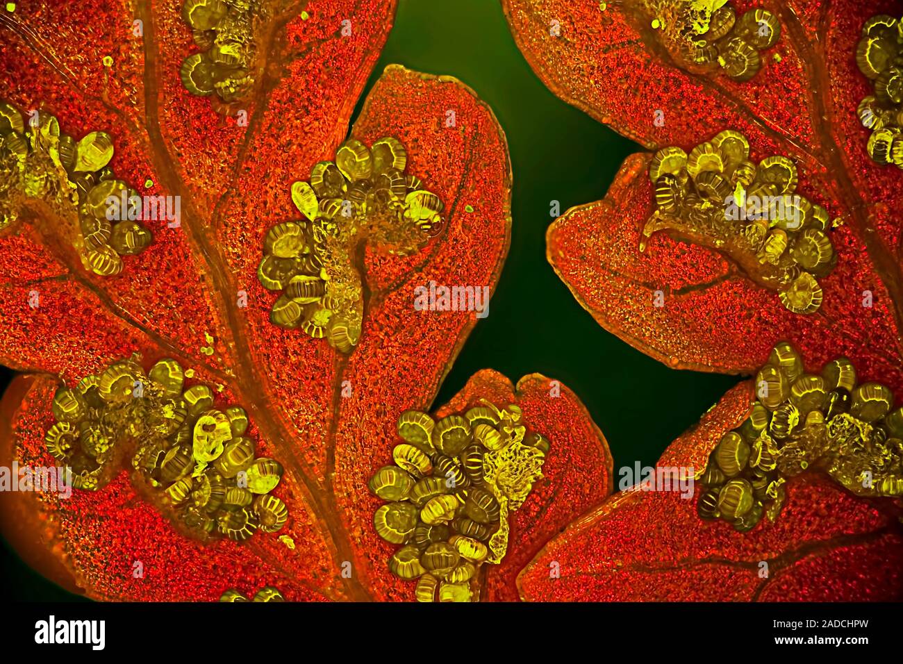 Fern sorus. Fluorescence light micrograph of a sorus on the underside ...