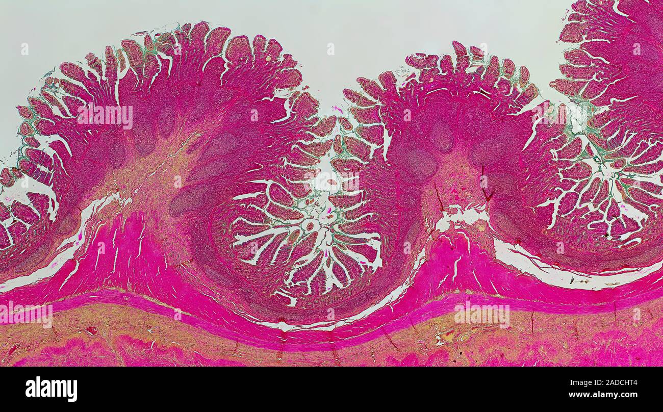 Small intestine. Light micrograph of a transverse section through the ...