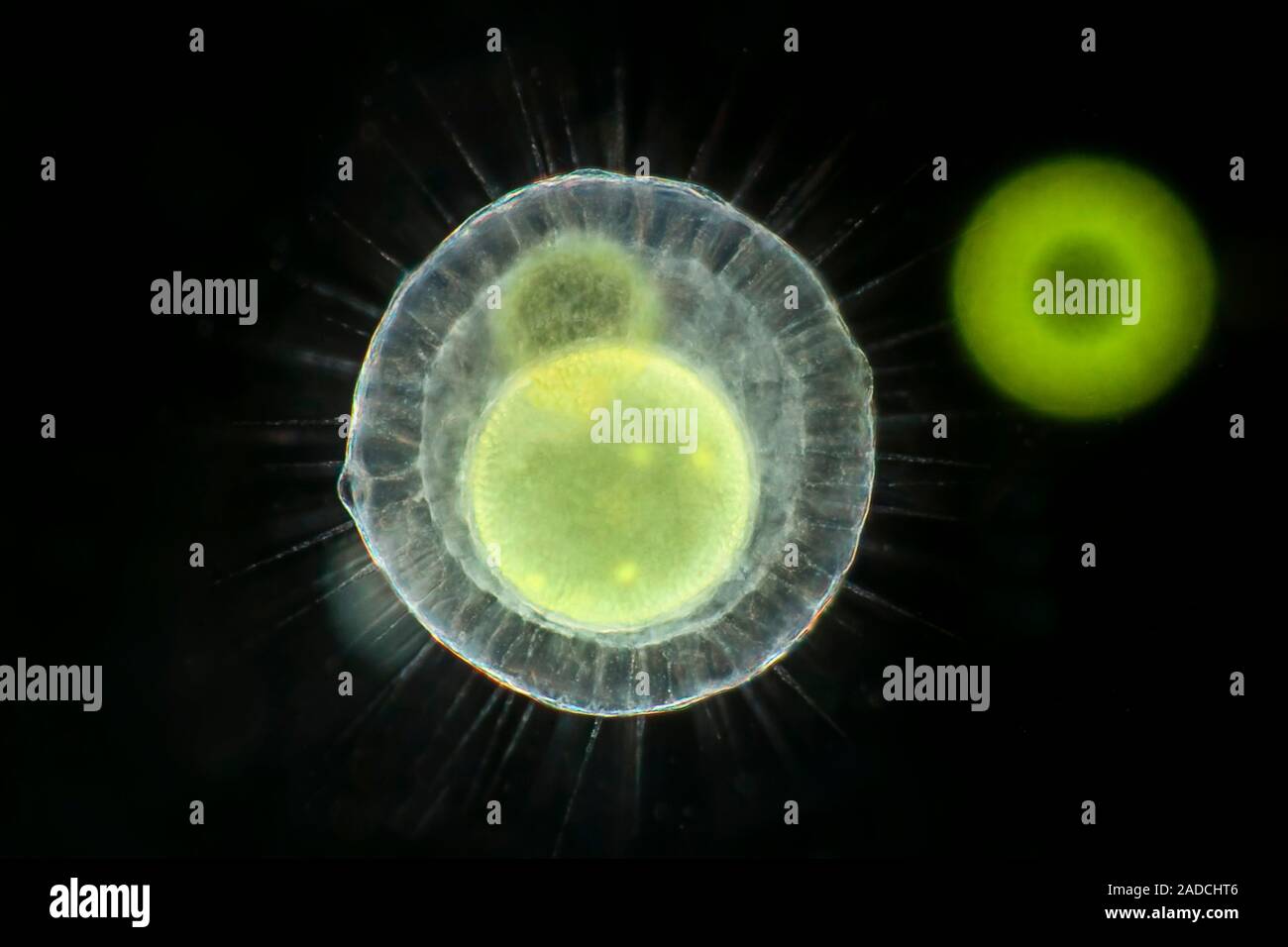 Heliozoa protozoan feeding on volvox, darkfield light micrograph ...