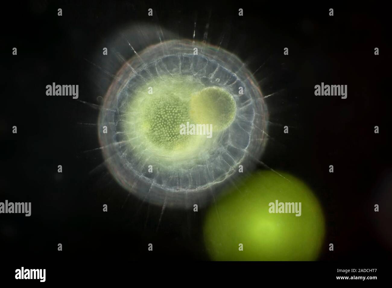 Heliozoa protozoan feeding on volvox, darkfield light micrograph ...