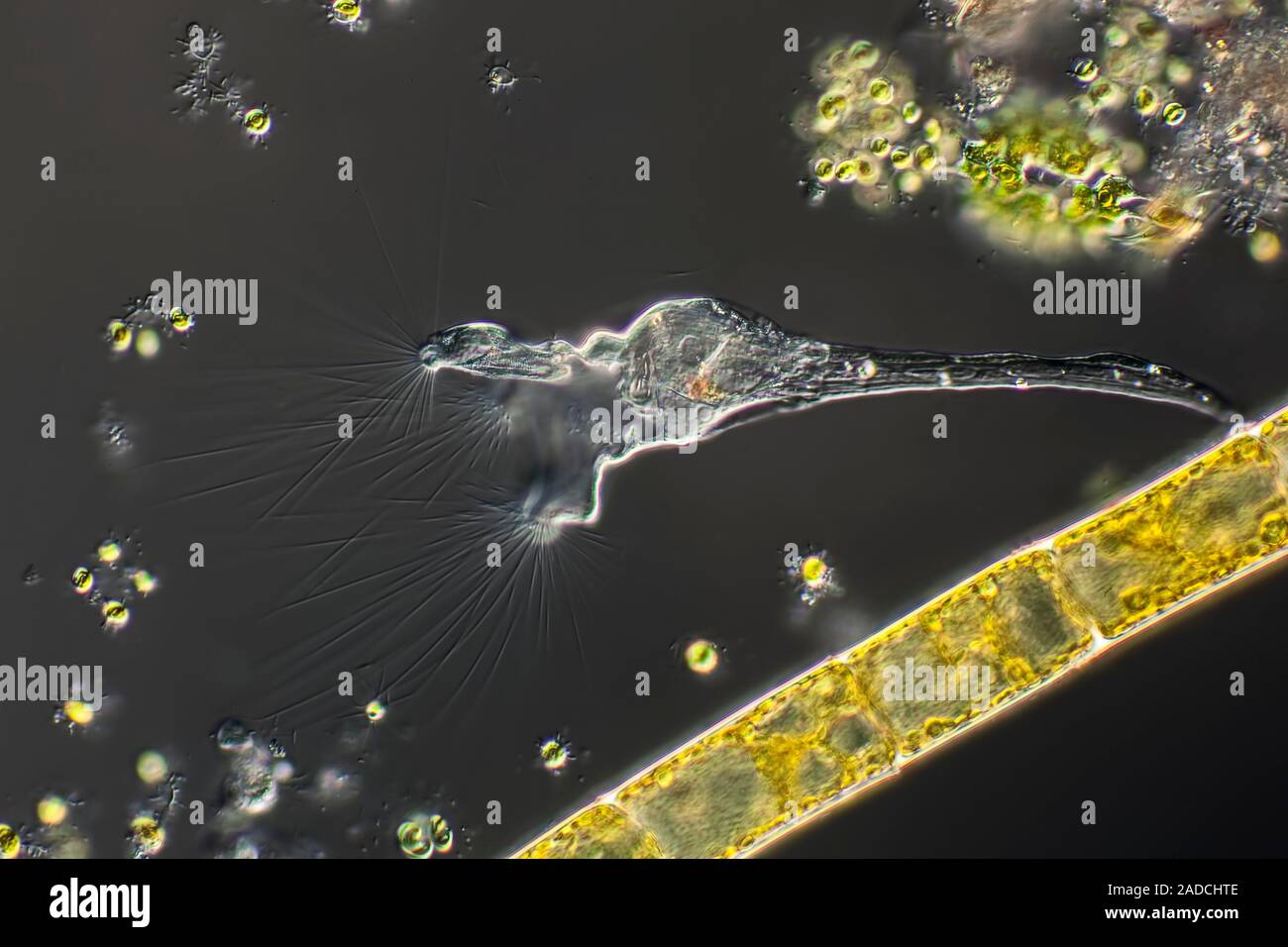 Darkfield light micrograph of a Collotheca sp. rotifer. Rotifers are ...