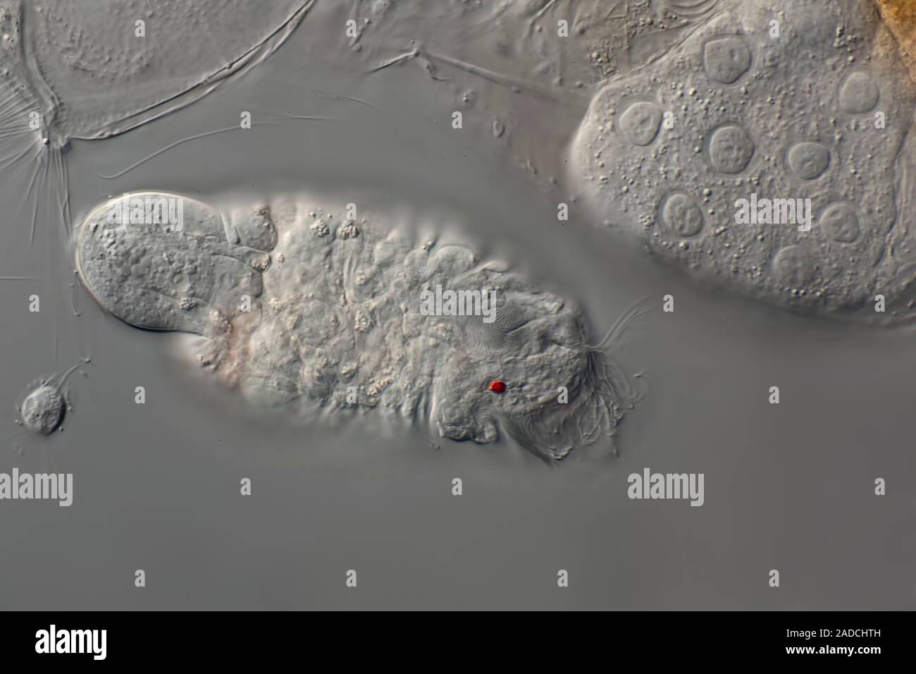 Collotheca sp. rotifer, just hatched from a egg, darkfield light ...