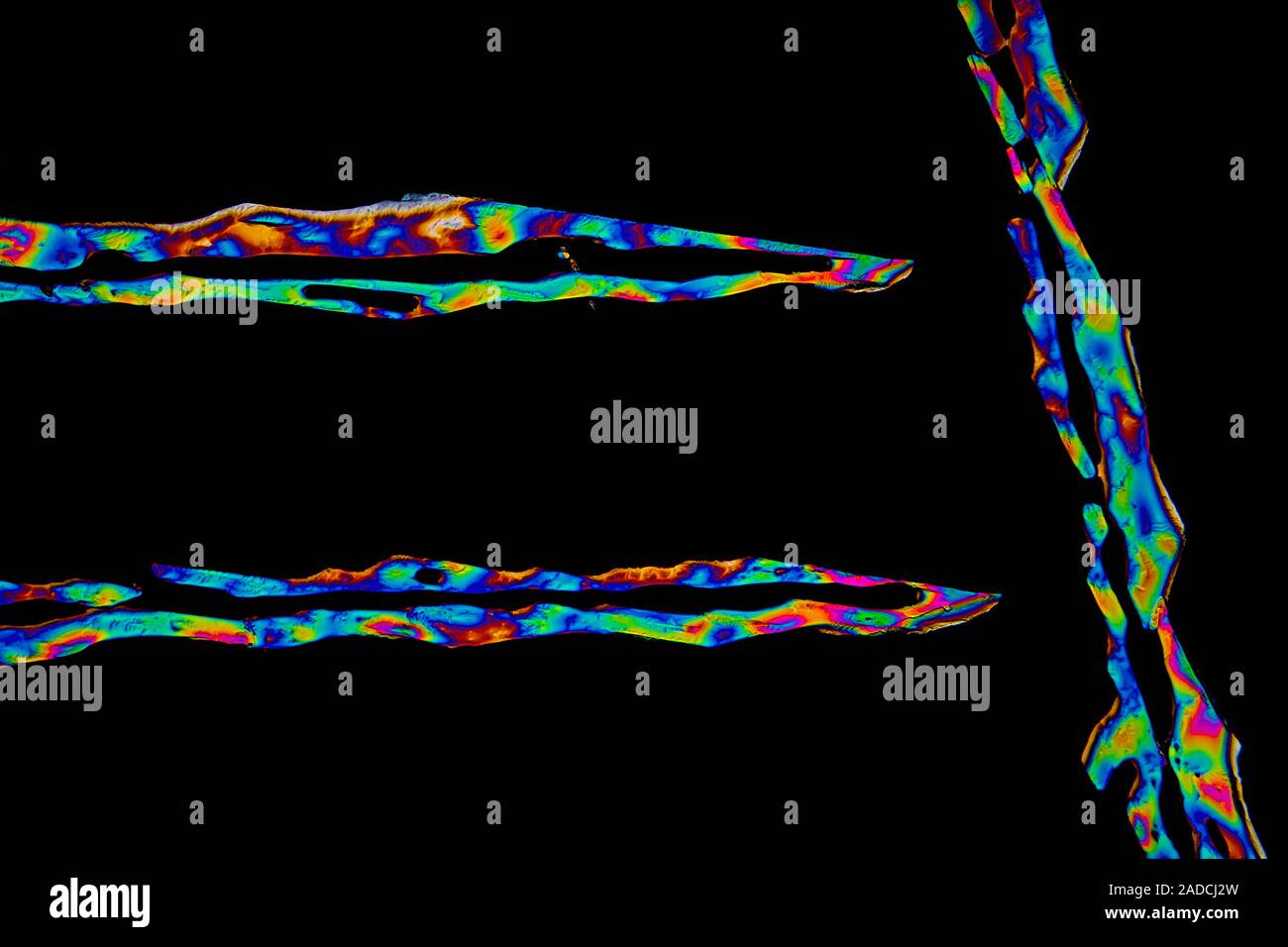 Polarized light micrograph of urea crystals, also known as carbamide, a ...