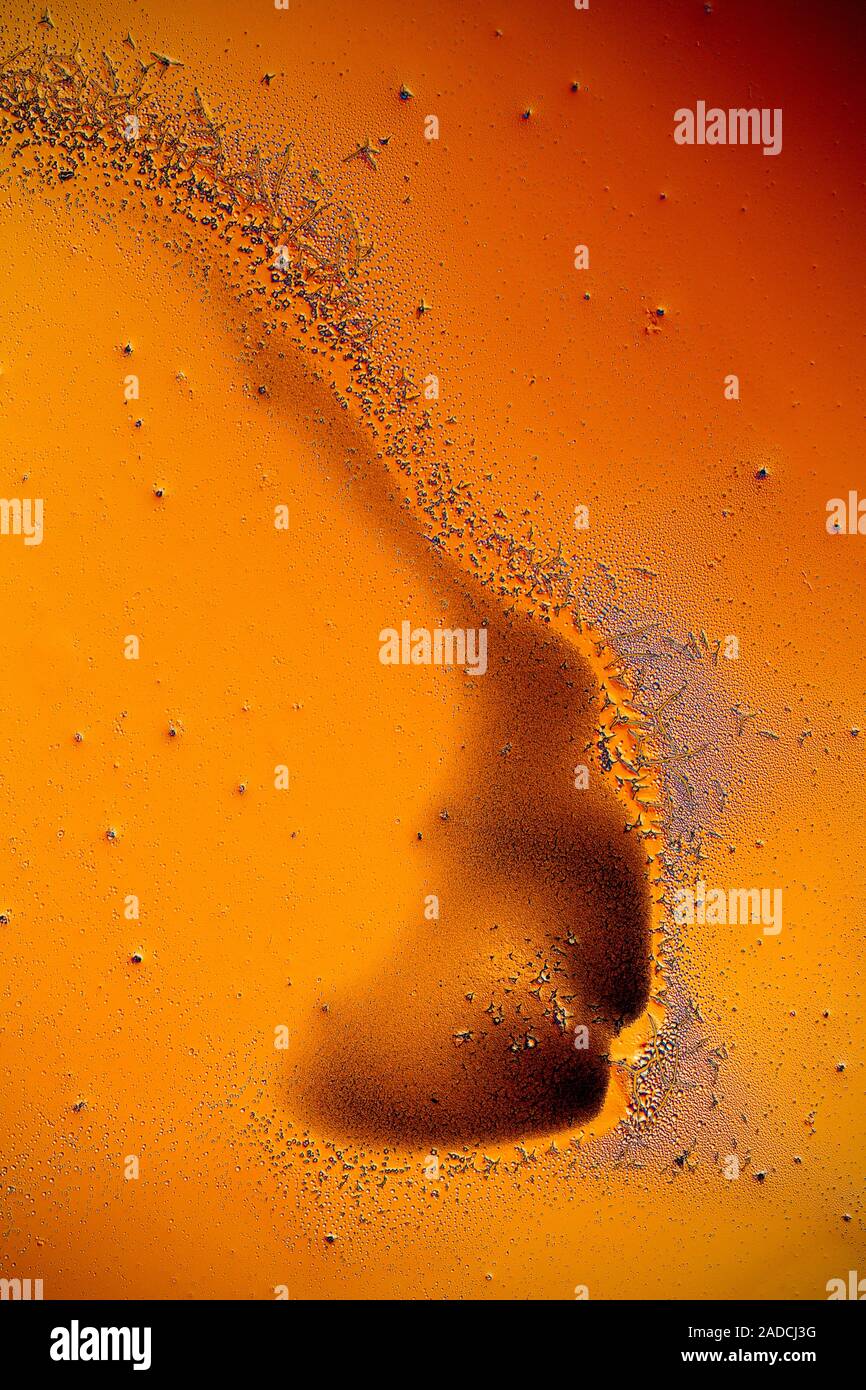 Polarized light micrograph of heparin crystals, an anticoagulant and ...