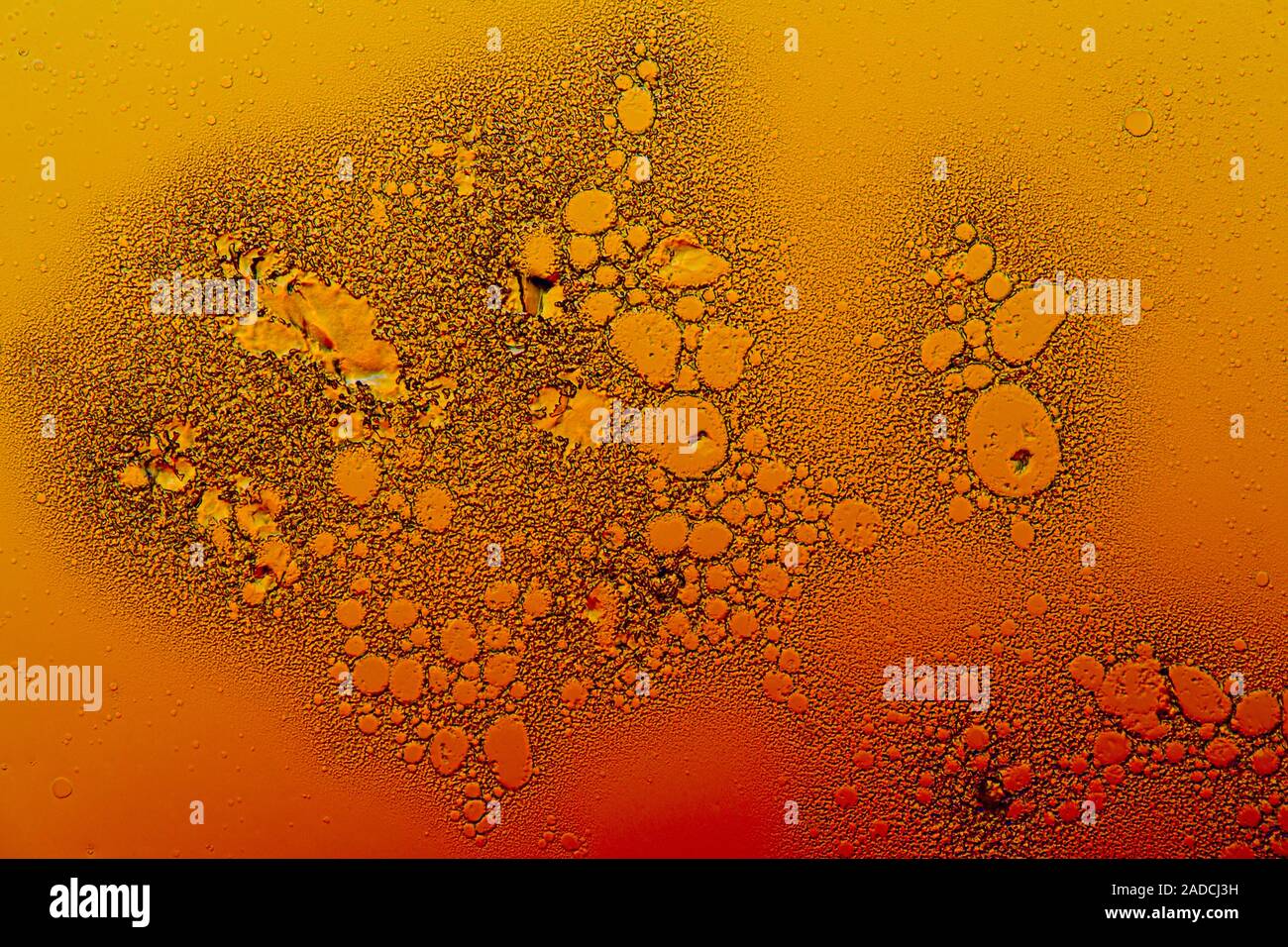 Polarized light micrograph of heparin crystals, an anticoagulant and ...