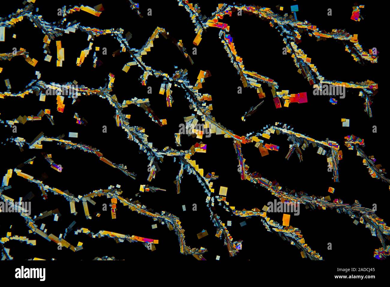 Polarized light micrograph of creatinine crystals, a breakdown product ...