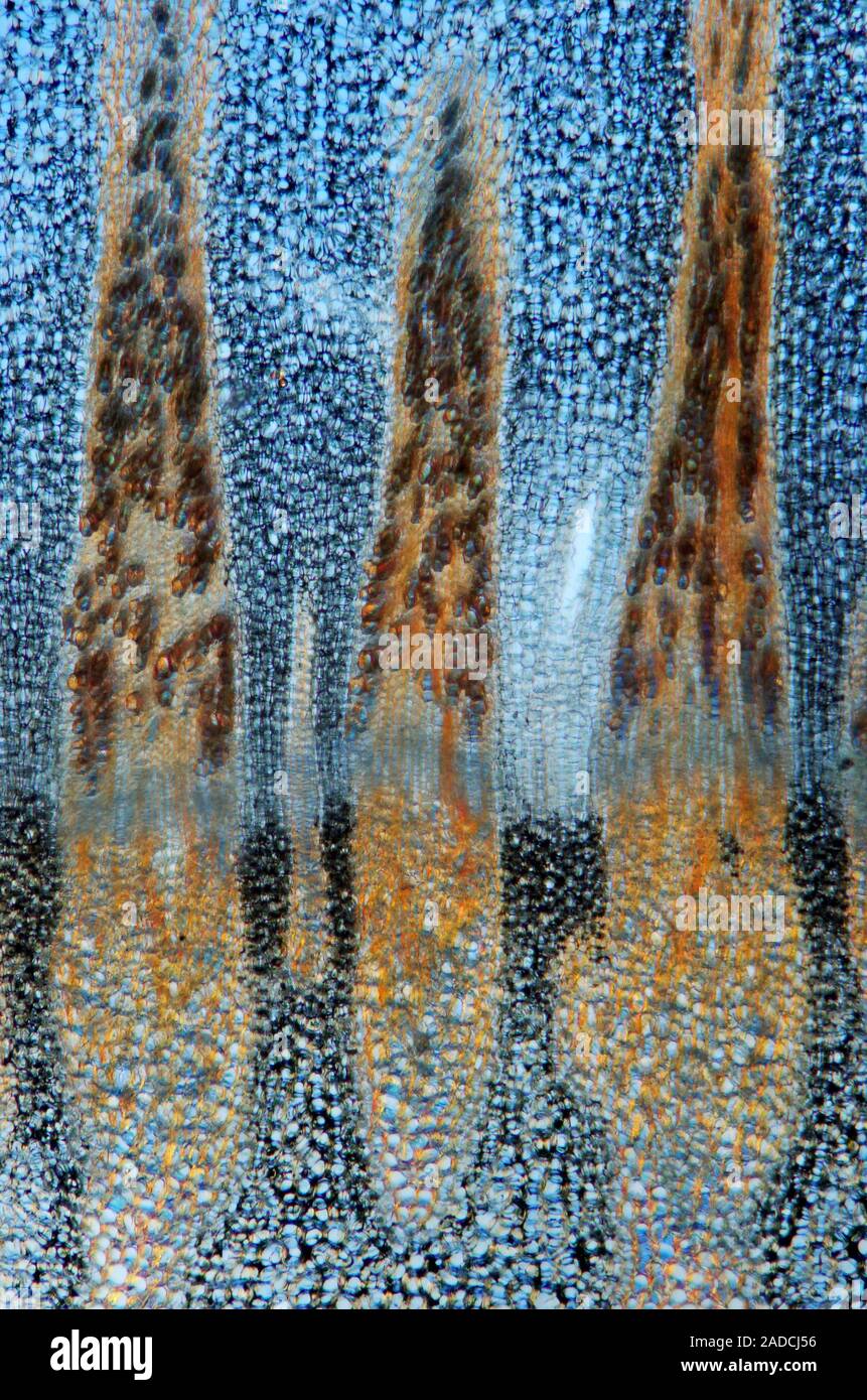 Broccoli (Brassica oleracea) stalk. Brightfield illuminated light ...