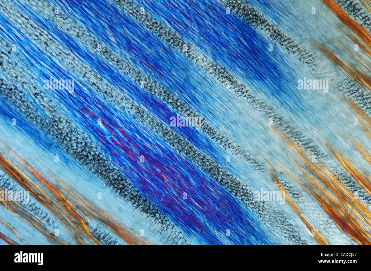 Broccoli (Brassica oleracea) stalk. Polarised light micrograph of a ...