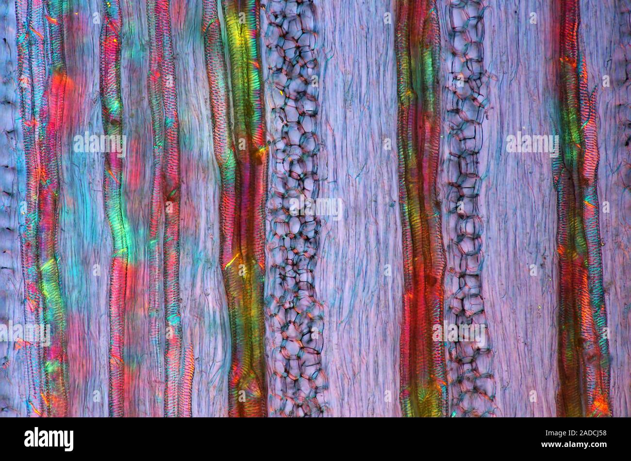 Broccoli (Brassica oleracea) stalk. Polarised light micrograph of a ...