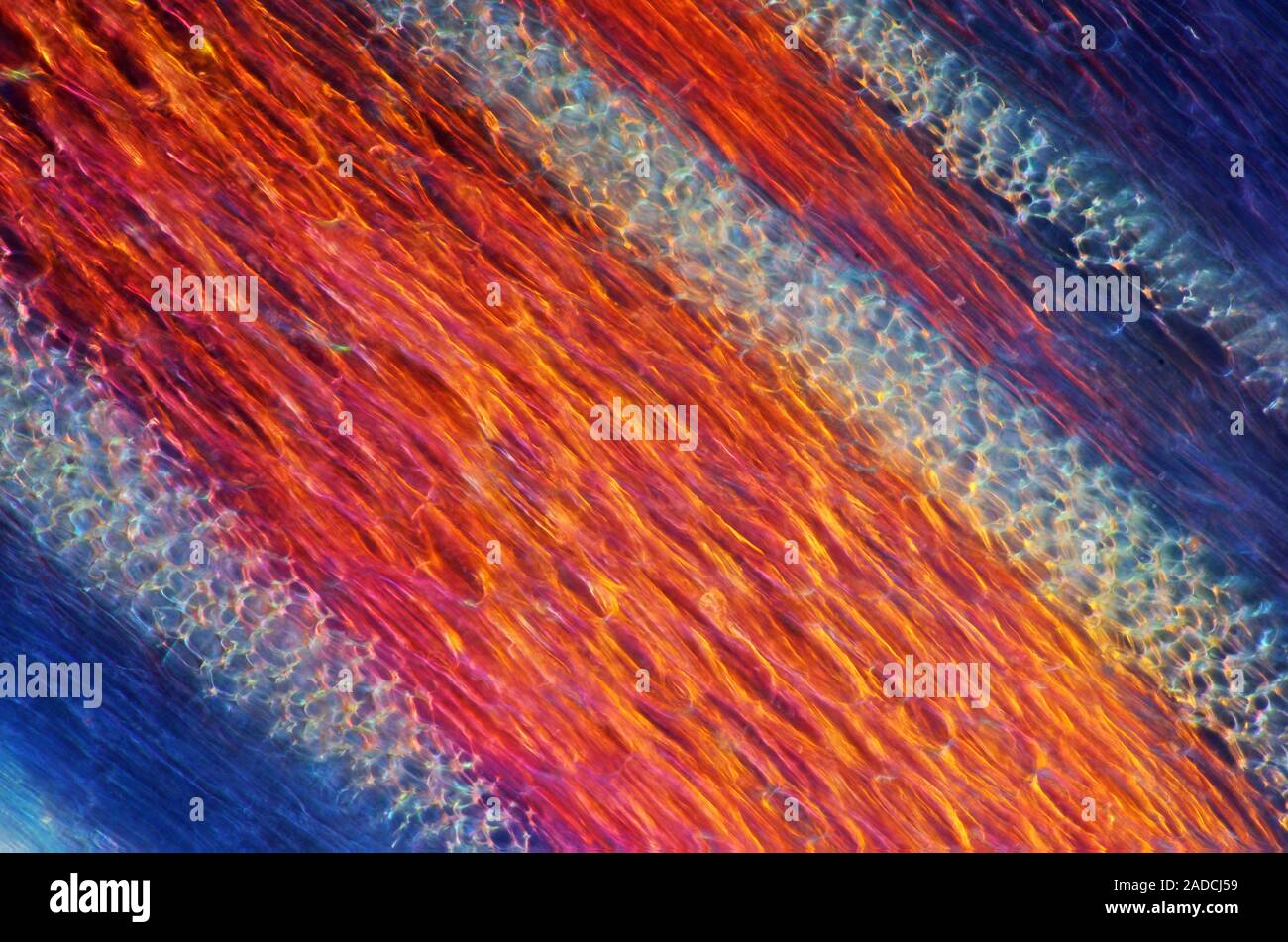 Broccoli (Brassica oleracea) stalk. Polarised light micrograph of a ...
