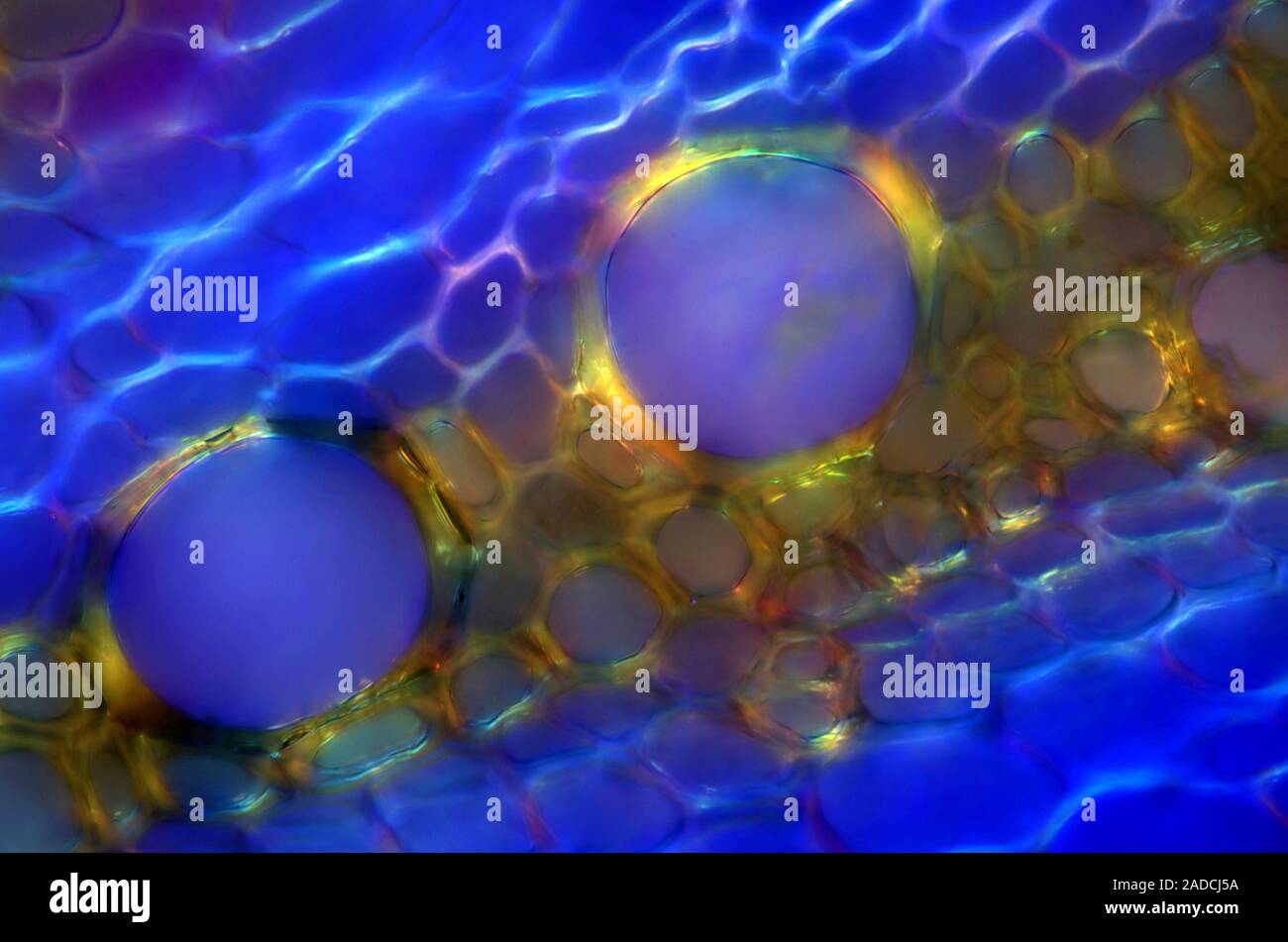 Beetroot (Beta vulgaris) tissue. Polarised light micrograph of a ...