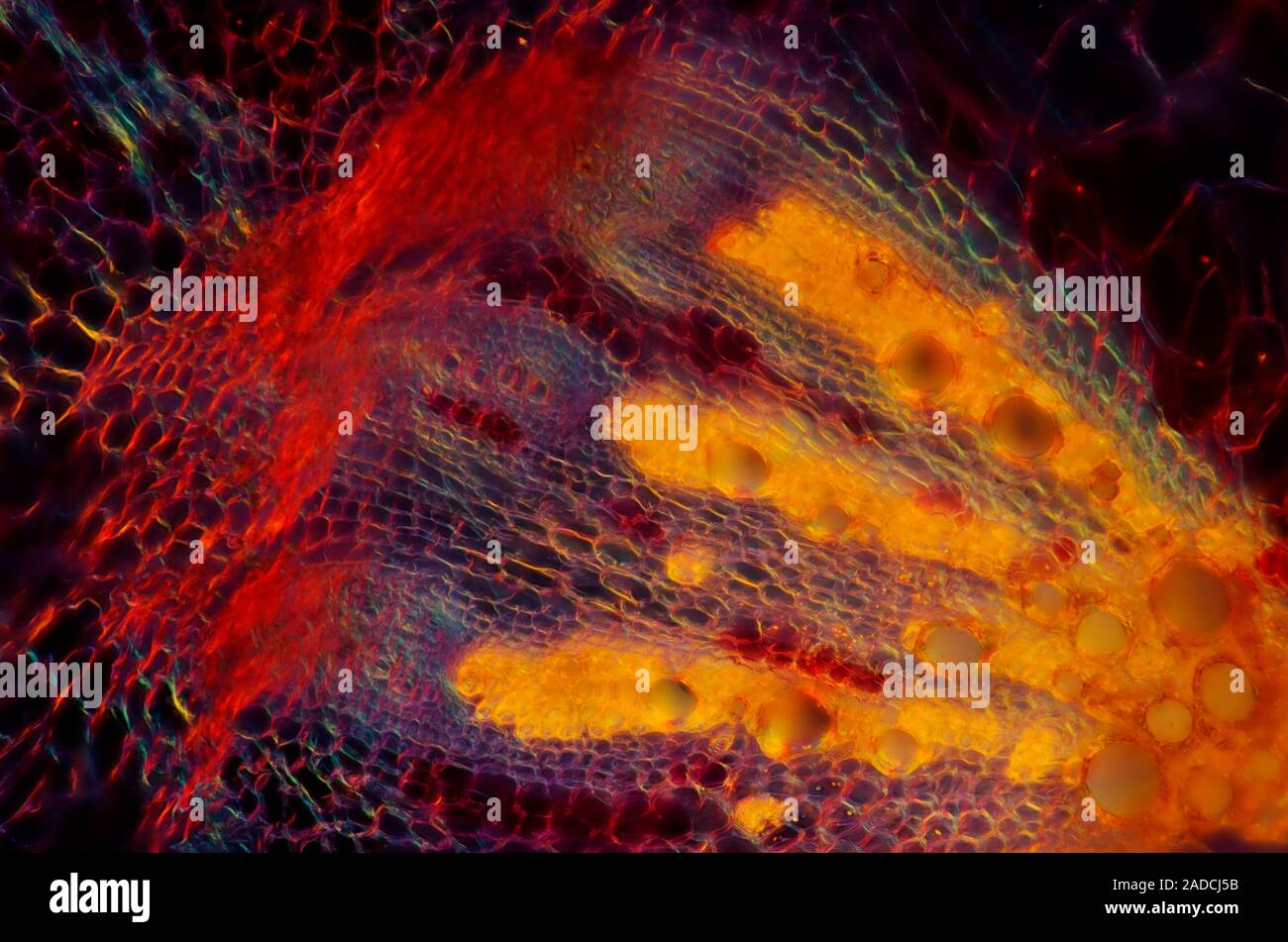 Beetroot (Beta vulgaris) tissue. Darkfield illuminated polarised light ...